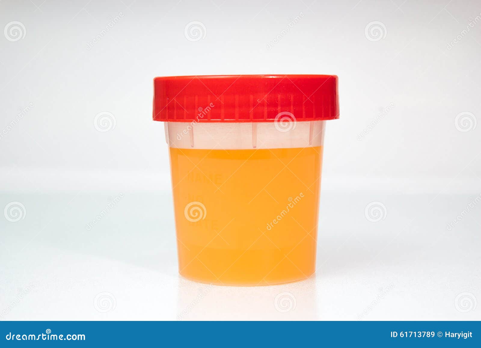 Urin-Probe in Geschlossener Transparenter Plastikdose Stockbild - Bild ...