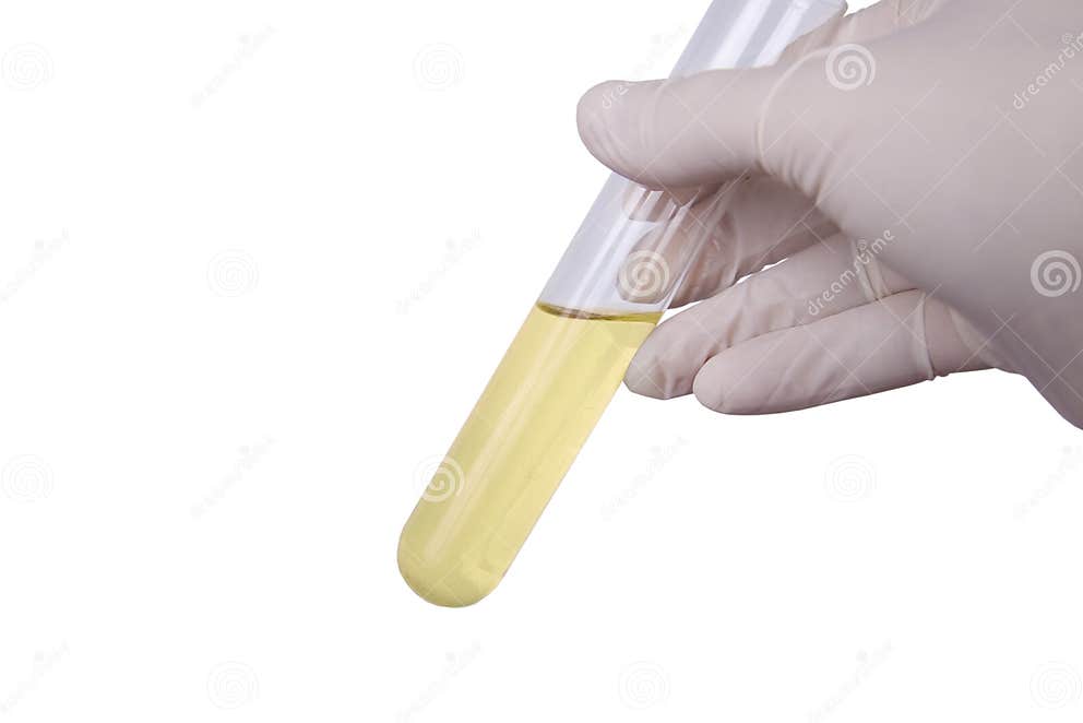 Urin sample stock image. Image of check, experiment, health - 11241283