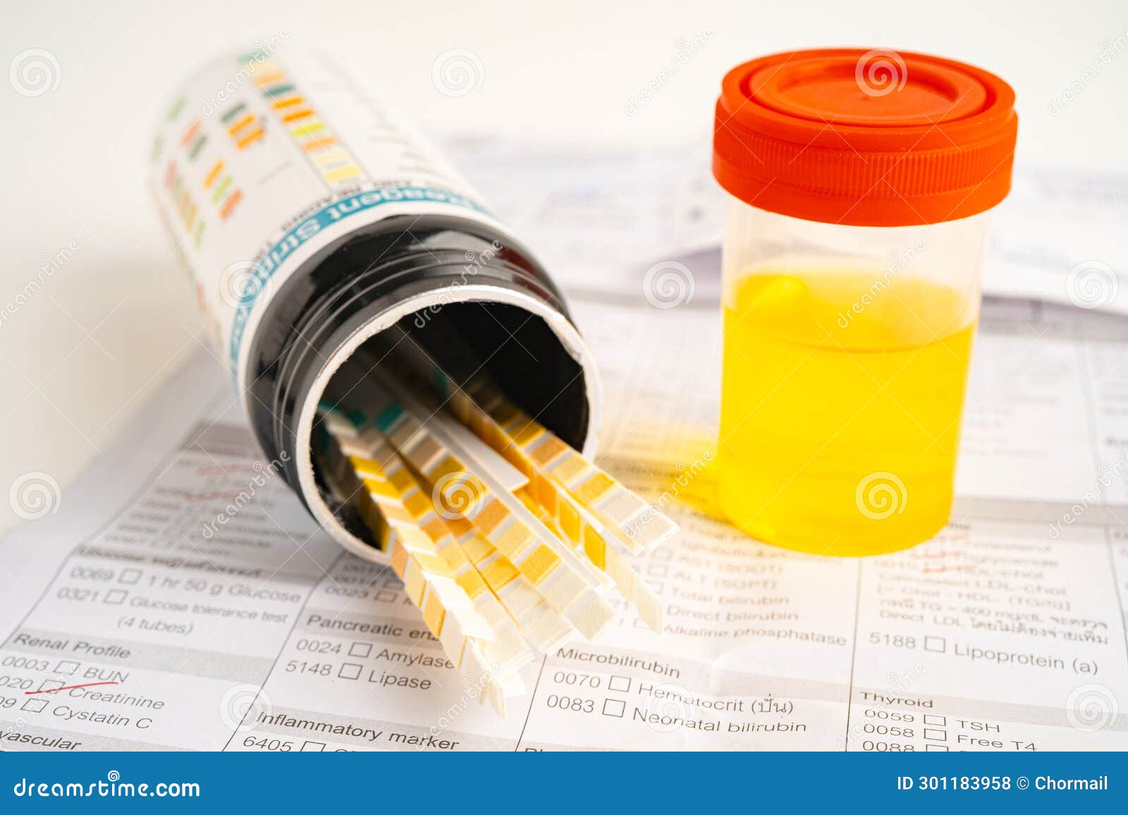 Urinalysis, Urine Cup with Reagent Strip PH Paper Test and Comparison ...