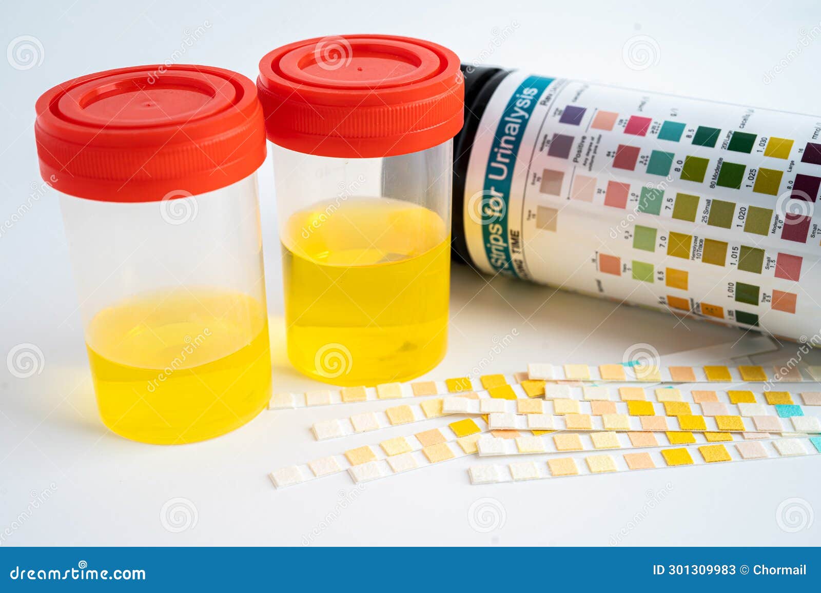 Urinalysis, Urine Cup With Reagent Strip PH Paper Test And Comparison ...