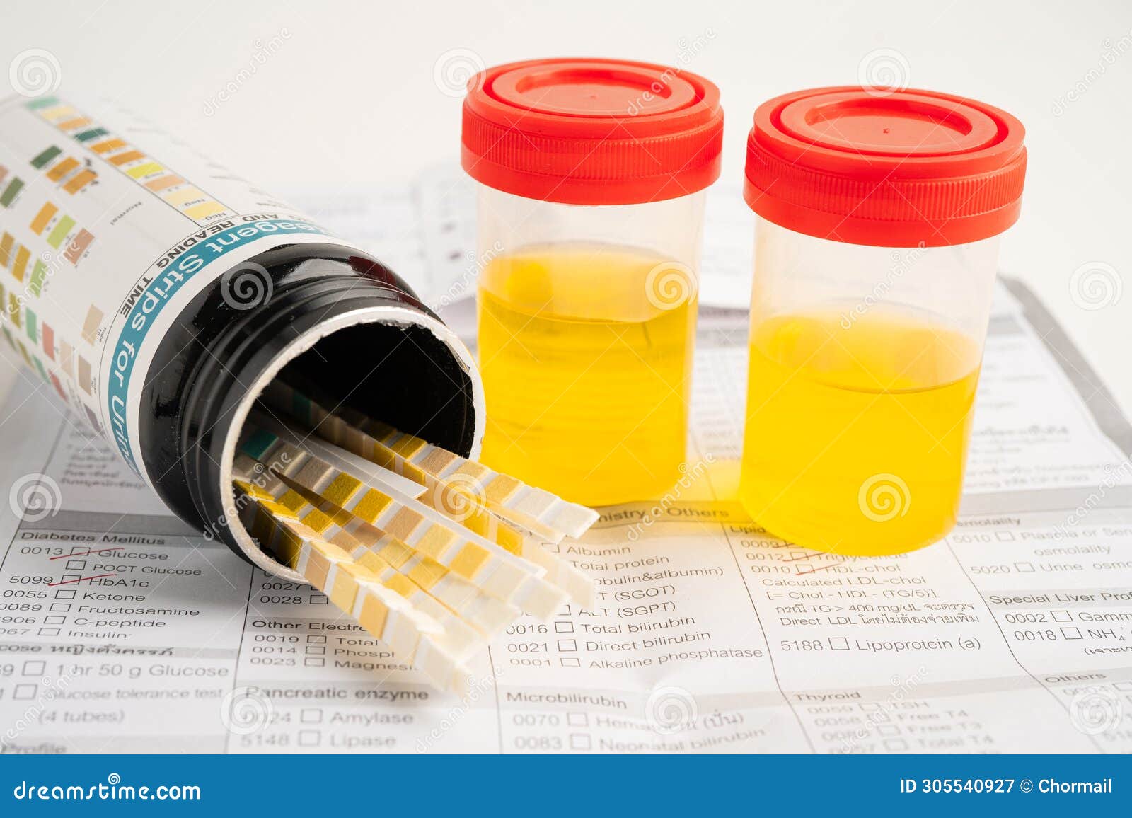 Urinalysis, Urine Cup with Reagent Strip PH Paper Test and Comparison ...