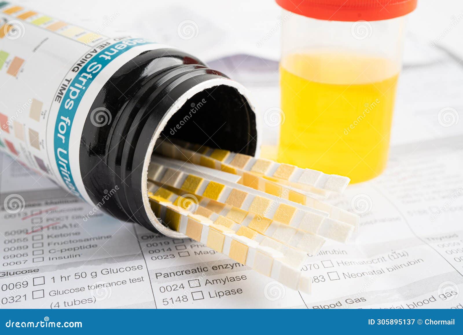 Urinalysis, Urine Cup With Reagent Strip PH Paper Test And Comparison ...