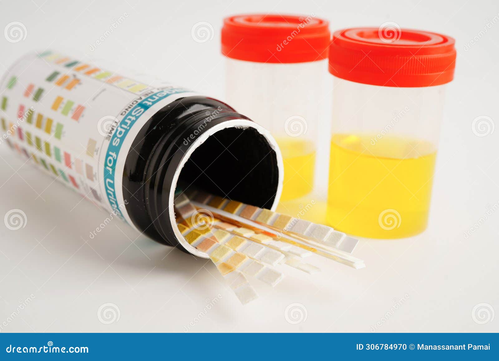 Urinalysis, Urine Cup with Reagent Strip PH Paper Test and Comparison ...