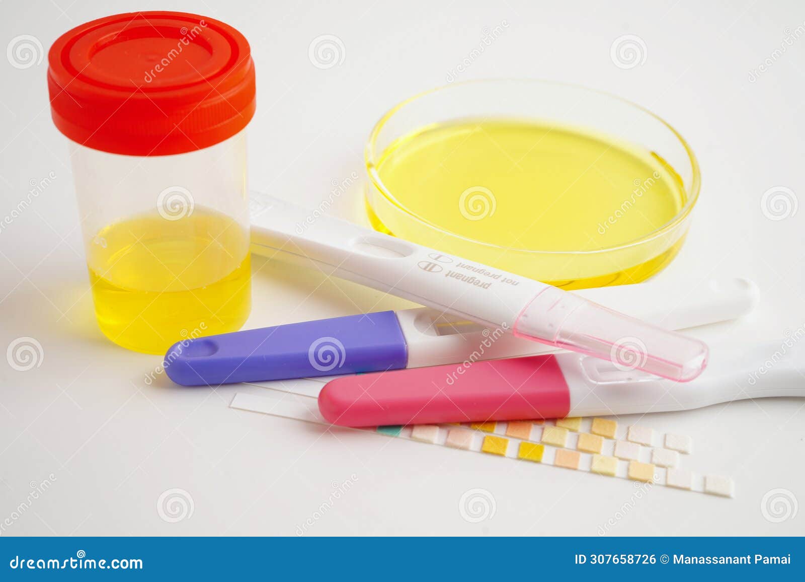 Urinalysis, Urine Cup With Reagent Strip PH Paper Test And Comparison ...