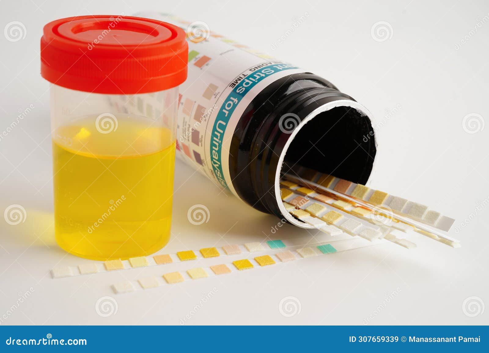 Urinalysis, Urine Cup with Reagent Strip PH Paper Test and Comparison ...