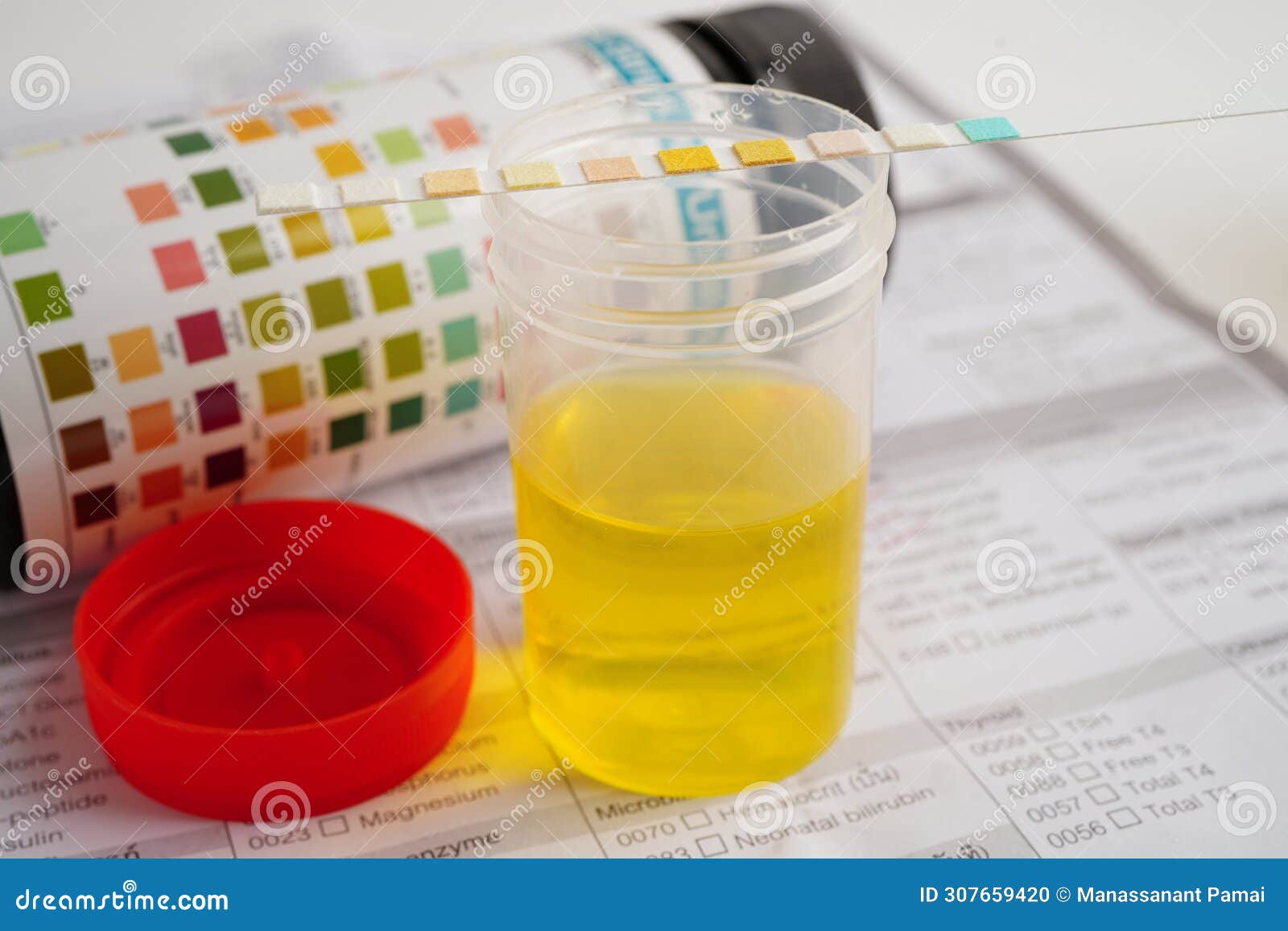 Urinalysis, Urine Cup with Reagent Strip PH Paper Test and Comparison ...