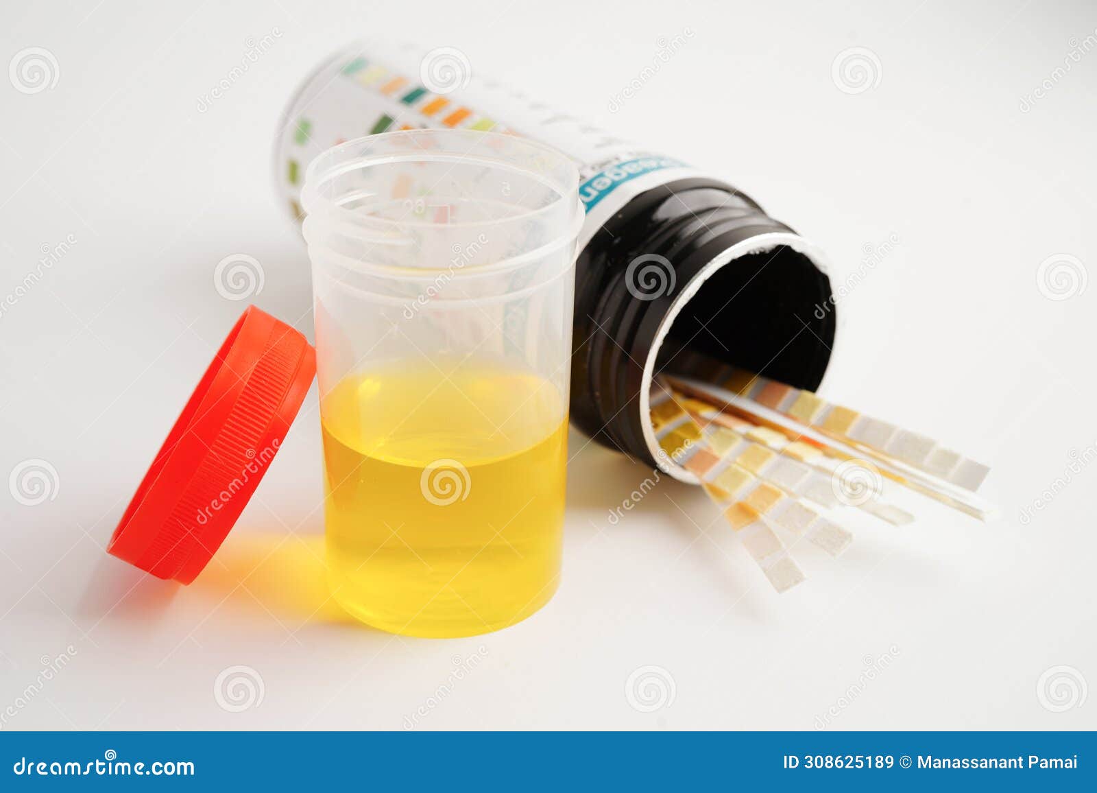Urinalysis, Urine Cup with Reagent Strip PH Paper Test and Comparison ...