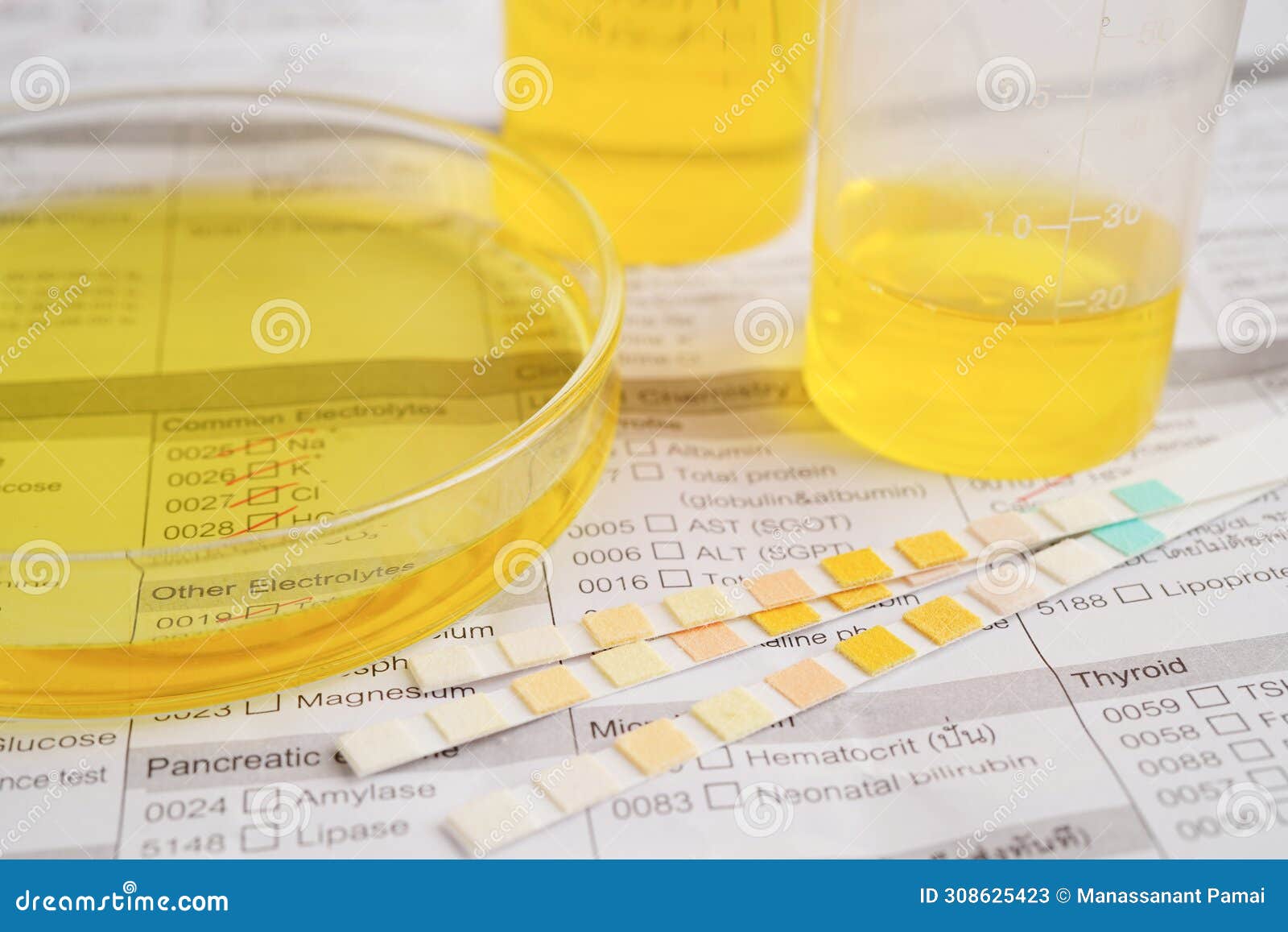 Urinalysis, Urine Cup with Reagent Strip PH Paper Test and Comparison ...
