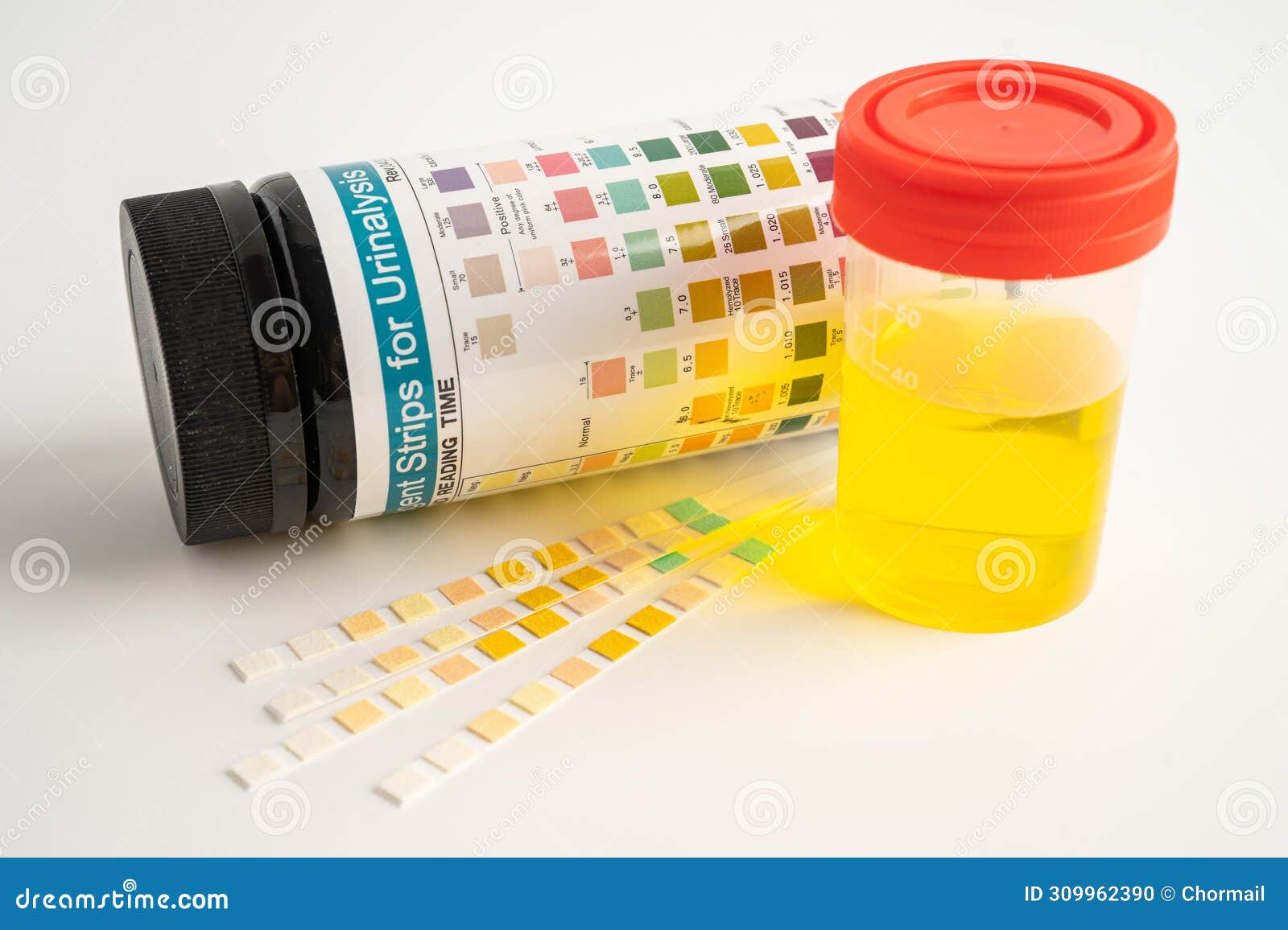Urinalysis, Urine Cup with Reagent Strip PH Paper Test and Comparison ...