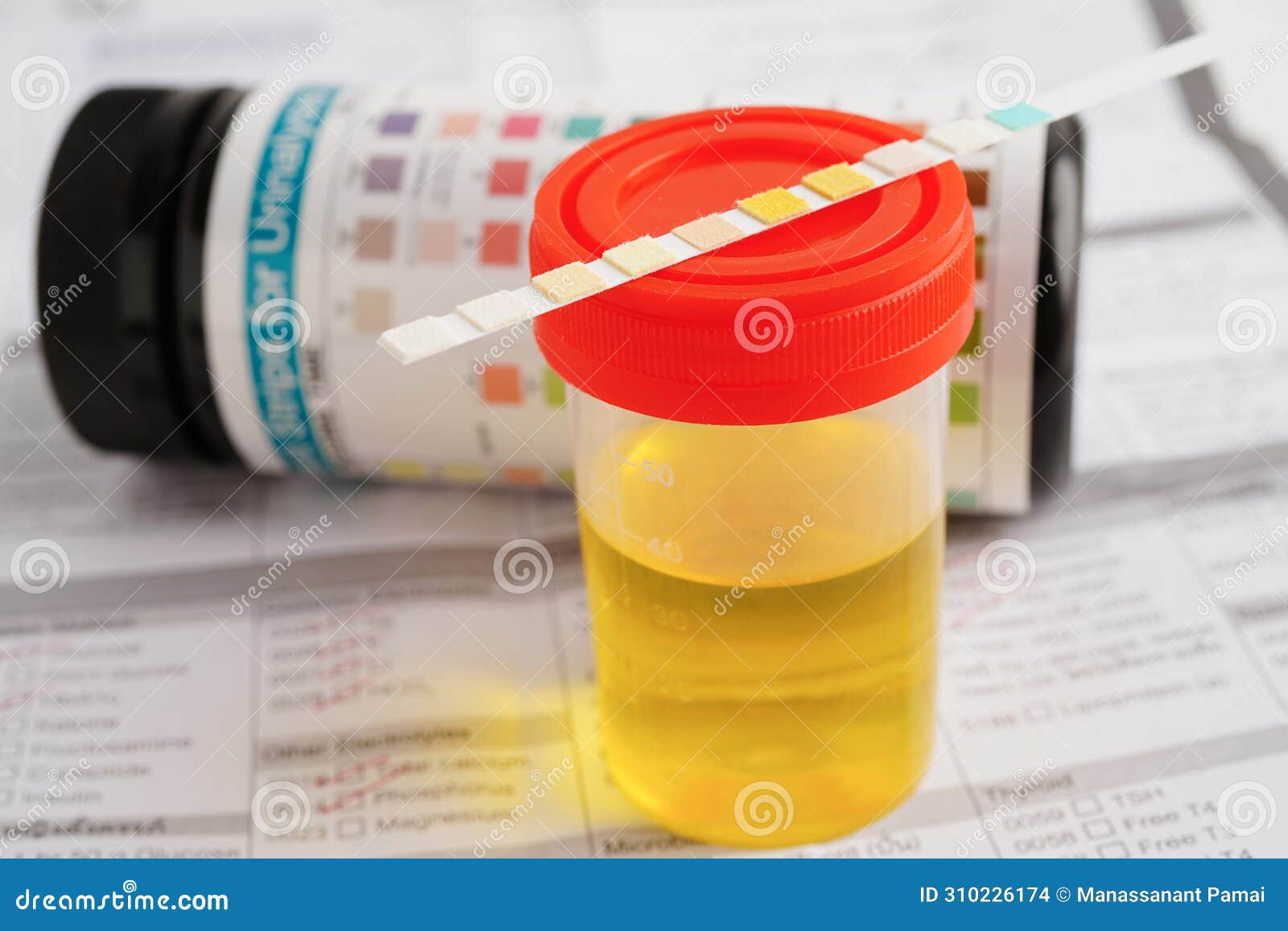 Urinalysis, Urine Cup with Reagent Strip PH Paper Test and Comparison ...