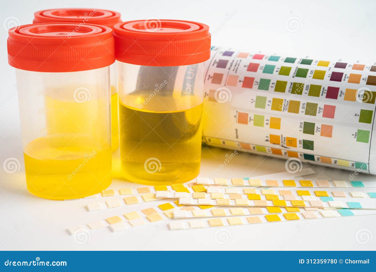 Urinalysis, Urine Cup with Reagent Strip PH Paper Test and Comparison ...