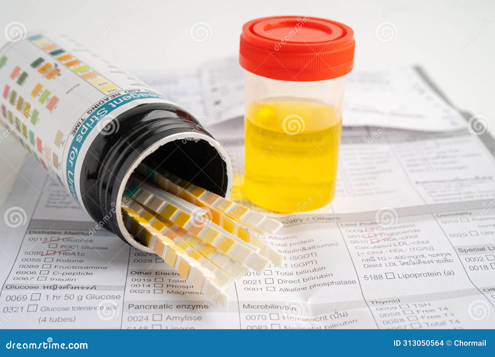 Urinalysis, Urine Cup with Reagent Strip PH Paper Test and Comparison ...