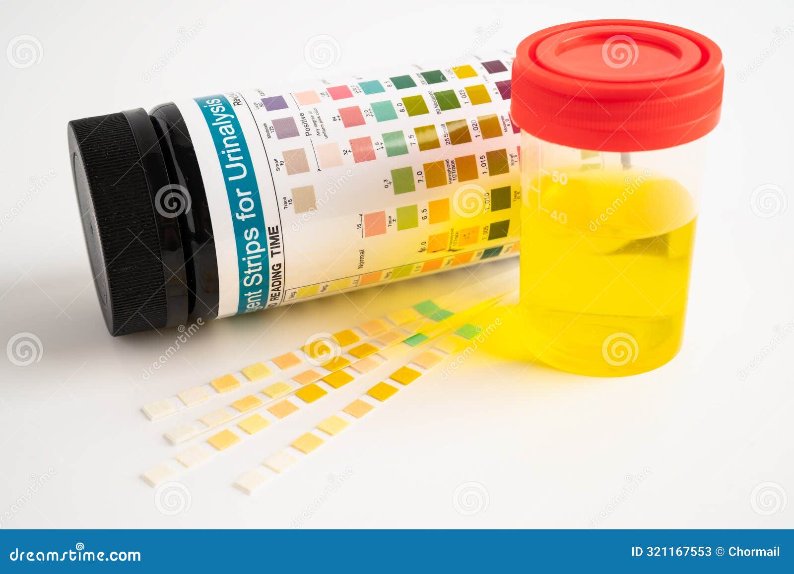 Urinalysis, Urine Cup With Reagent Strip PH Paper Test And Comparison ...