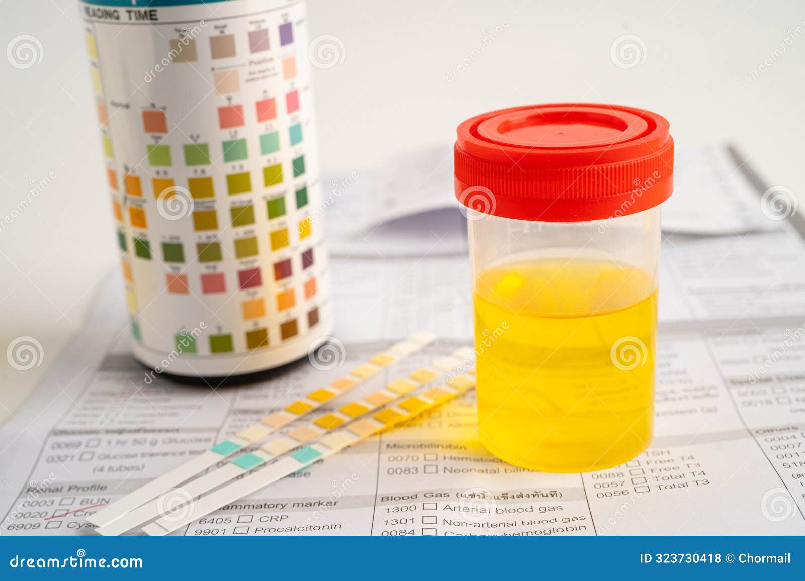 Urinalysis, Urine Cup With Reagent Strip PH Paper Test And Comparison ...