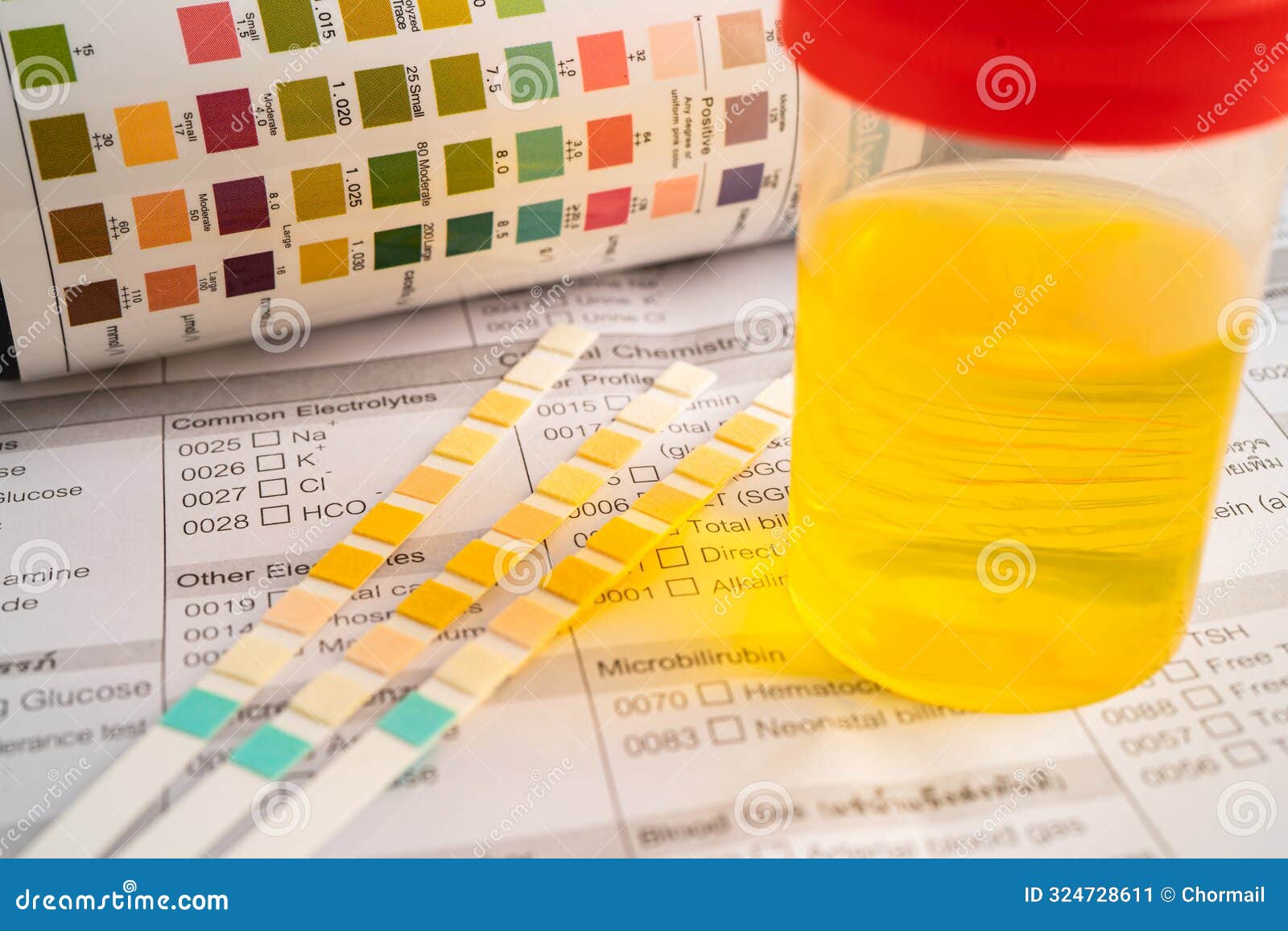 Urinalysis, Urine Cup With Reagent Strip PH Paper Test And Comparison ...