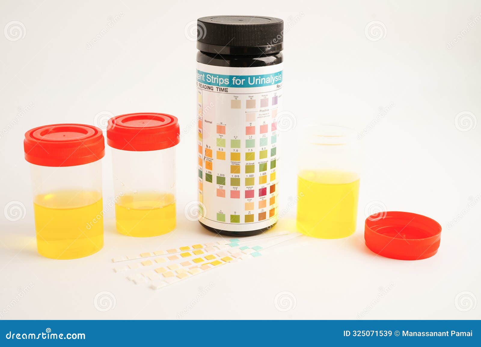 Urinalysis, Urine Cup With Reagent Strip PH Paper Test And Comparison ...