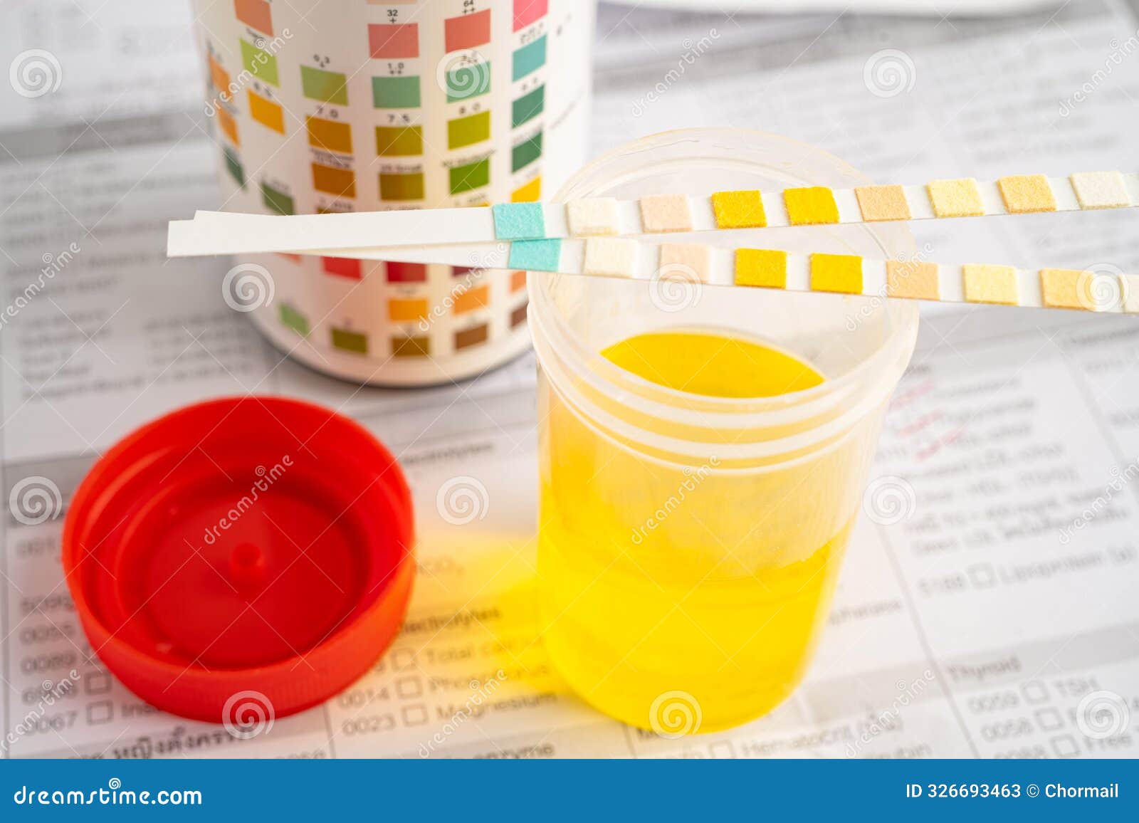 Urinalysis, Urine Cup with Reagent Strip PH Paper Test and Comparison ...