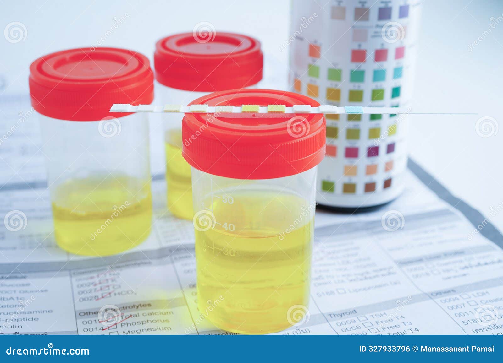 Urinalysis, Urine Cup with Reagent Strip PH Paper Test and Comparison ...
