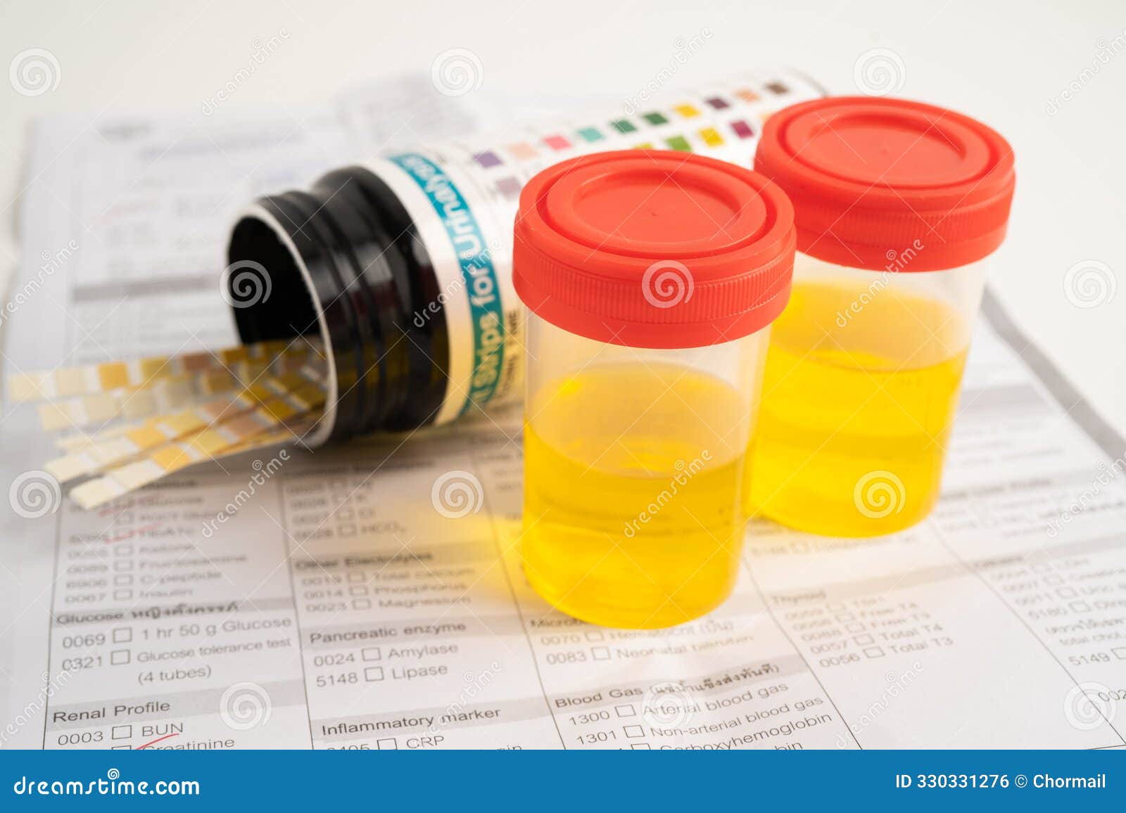 Urinalysis, Urine Cup With Reagent Strip PH Paper Test And Comparison ...