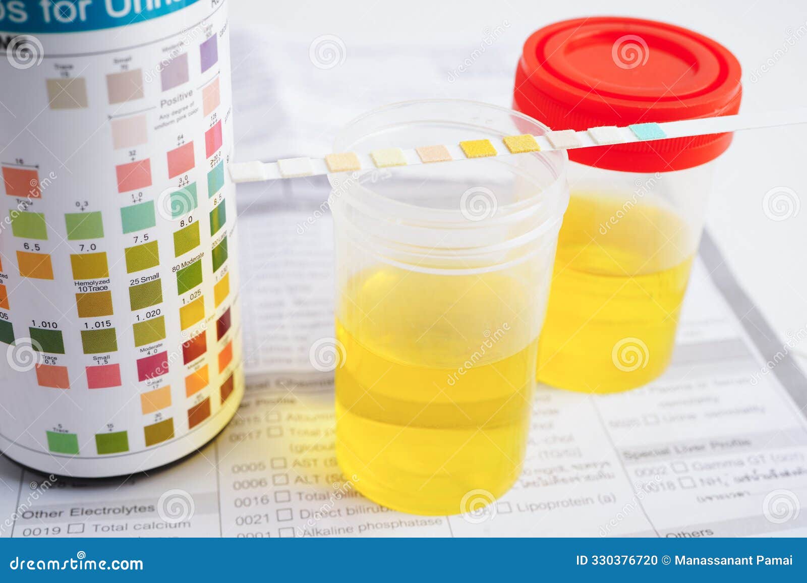 Urinalysis, Urine Cup With Reagent Strip PH Paper Test And Comparison ...