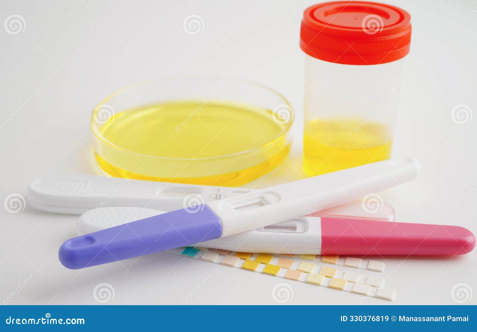 Urinalysis, Urine Cup with Reagent Strip PH Paper Test and Comparison ...
