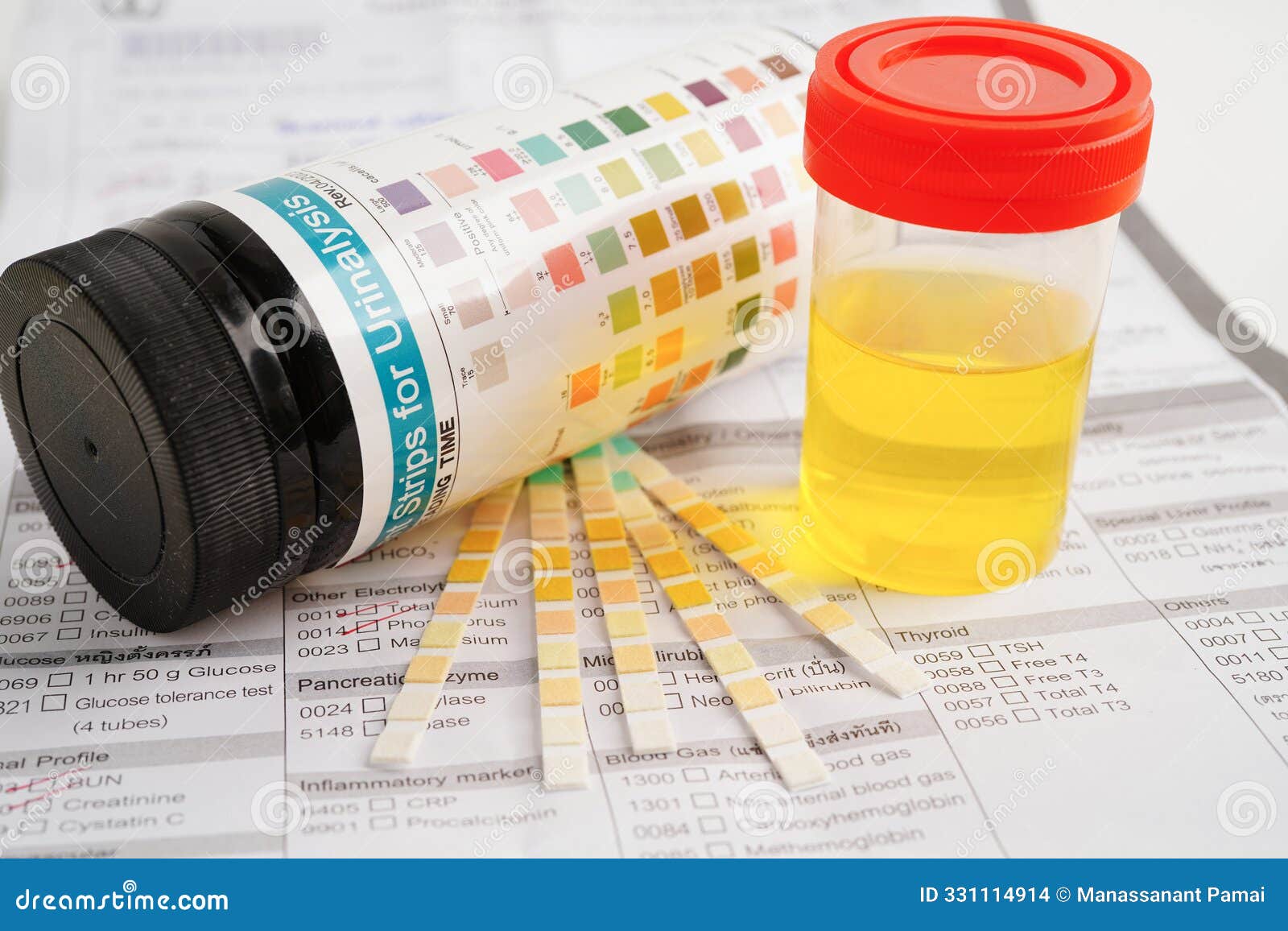 Urinalysis, Urine Cup With Reagent Strip PH Paper Test And Comparison ...