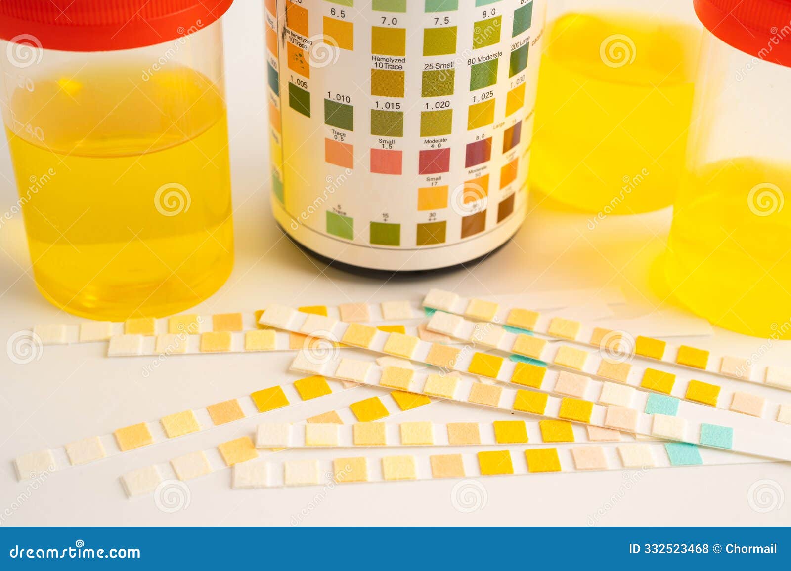 Urinalysis, Urine Cup With Reagent Strip PH Paper Test And Comparison ...