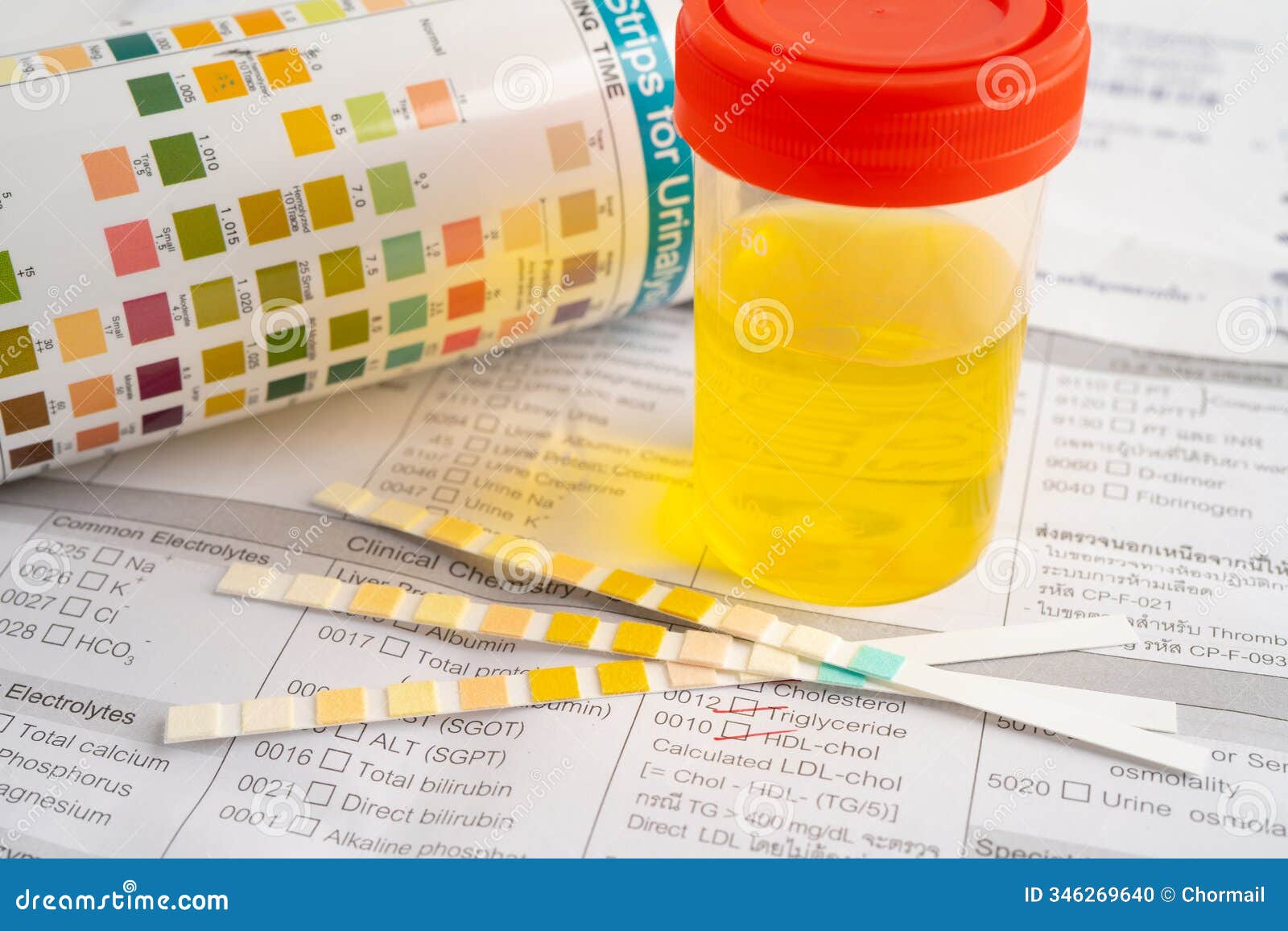 Reagent Strip For Urinalysis, Routine Urinalysis, Urine Test Analysis ...