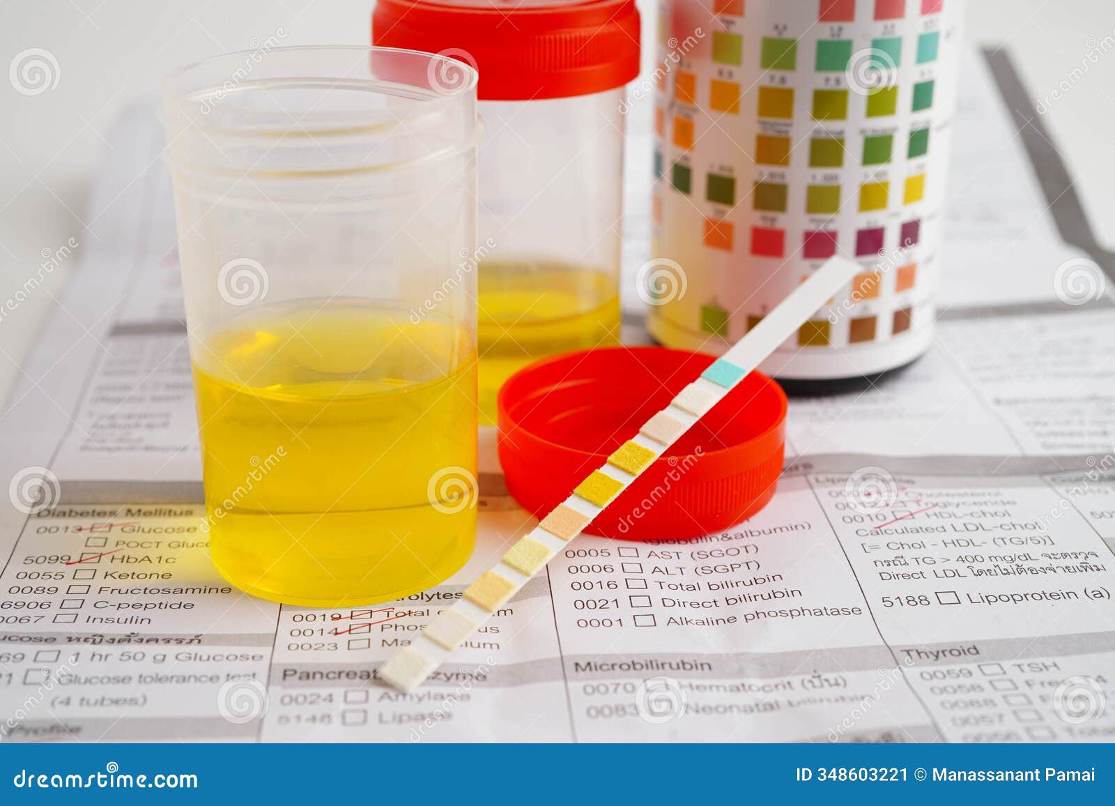 Urinalysis, Urine Cup With Reagent Strip PH Paper Test And Comparison ...
