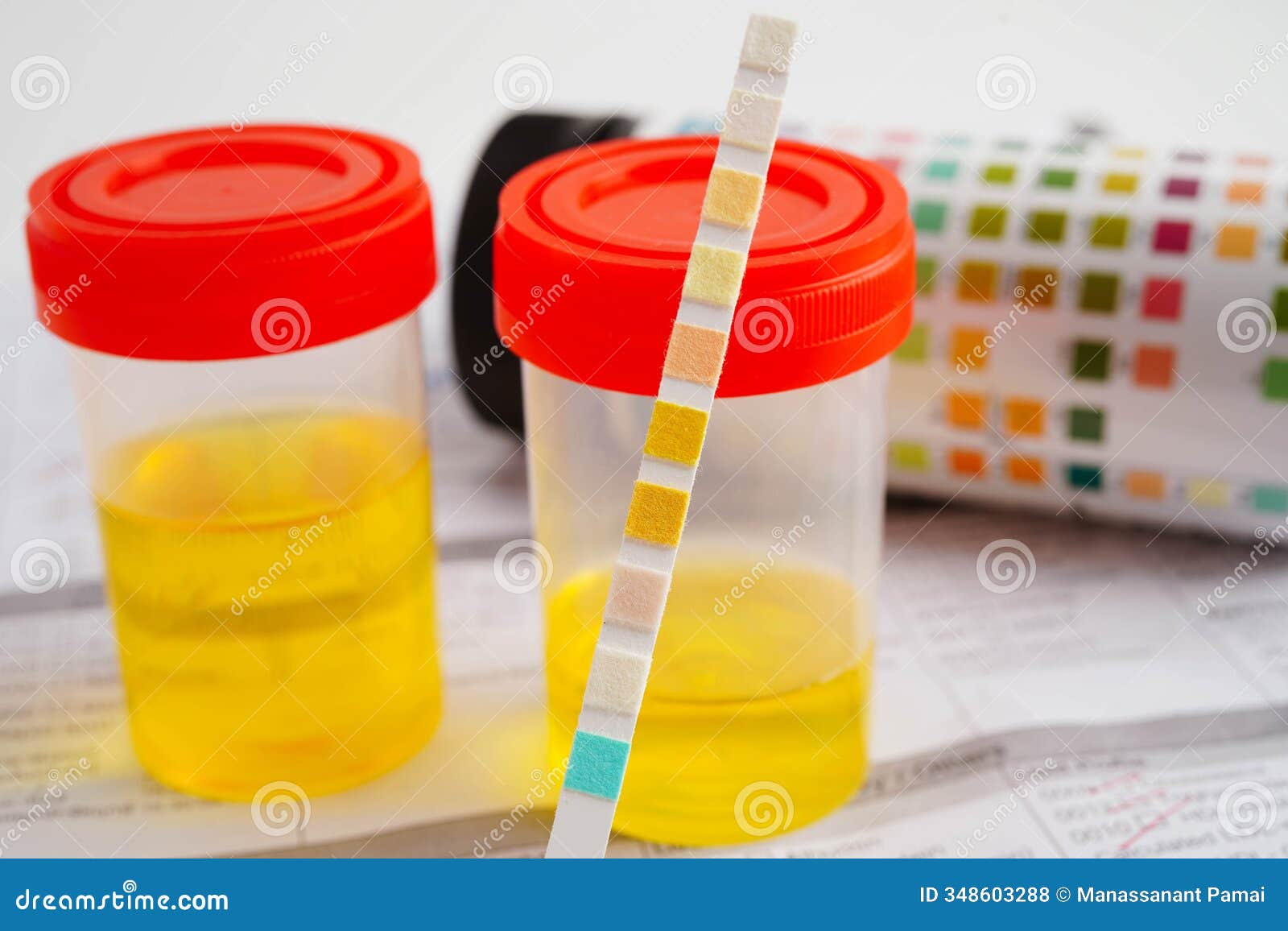 Urinalysis, Urine Cup With Reagent Strip PH Paper Test And Comparison ...