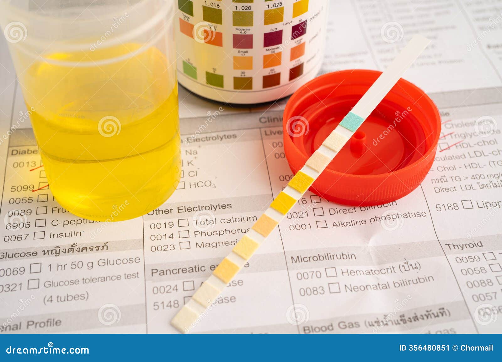 Urinalysis, Urine Cup with Reagent Strip PH Paper Test and Comparison ...