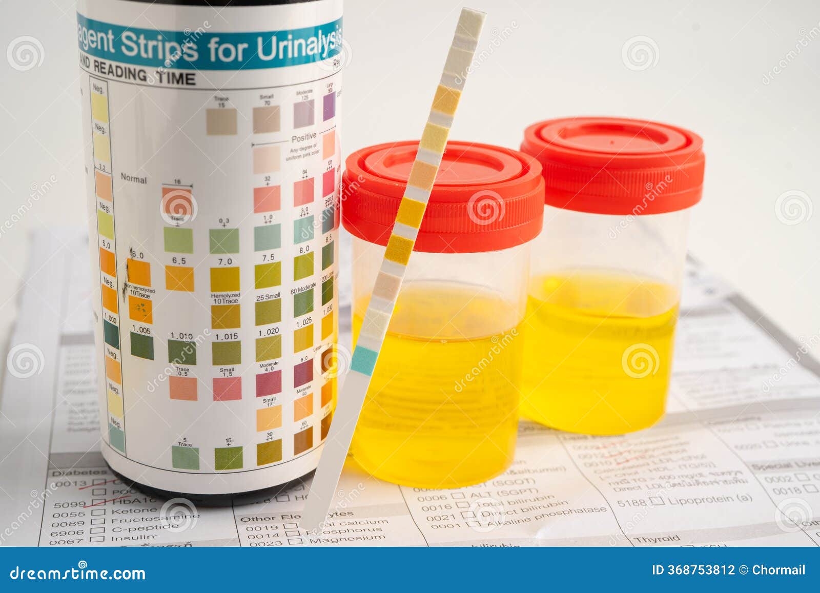 Reagent Strip Test Urinalysis In Laboratory Royalty-Free Stock Photo ...