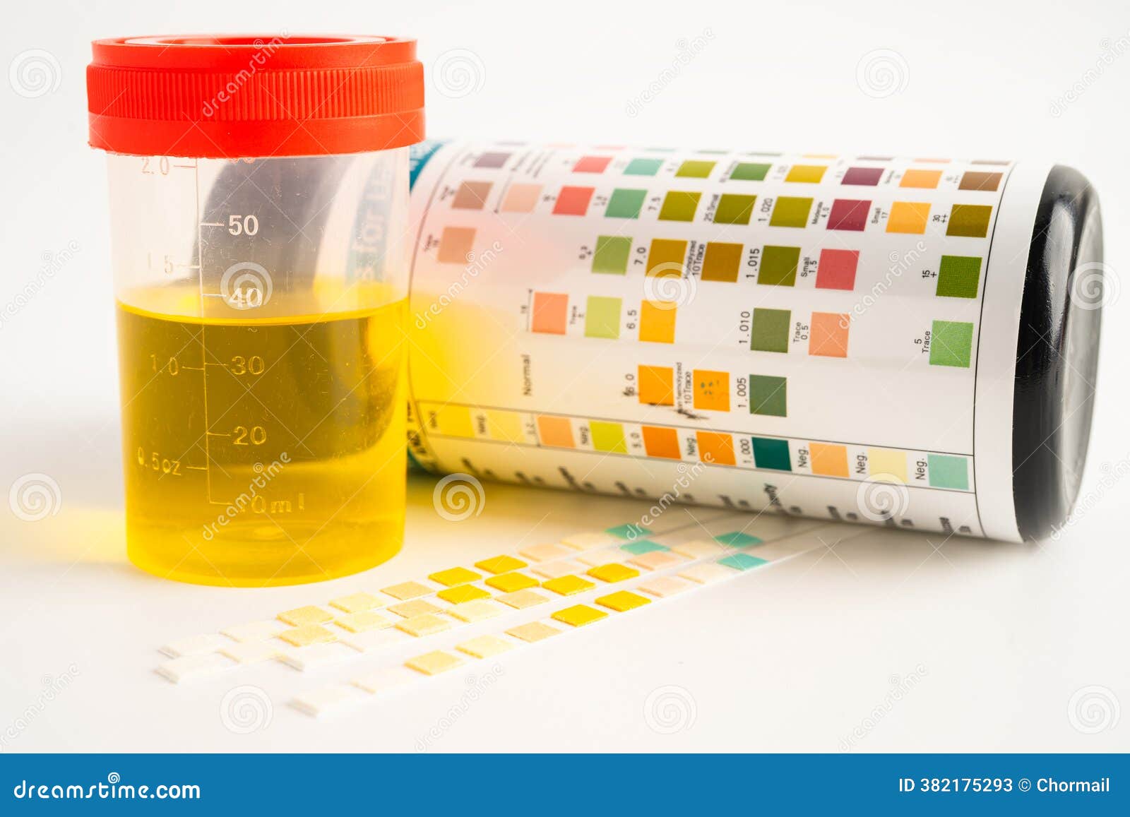 Urinalysis, Urine Cup With Reagent Strip PH Paper Test And Comparison ...