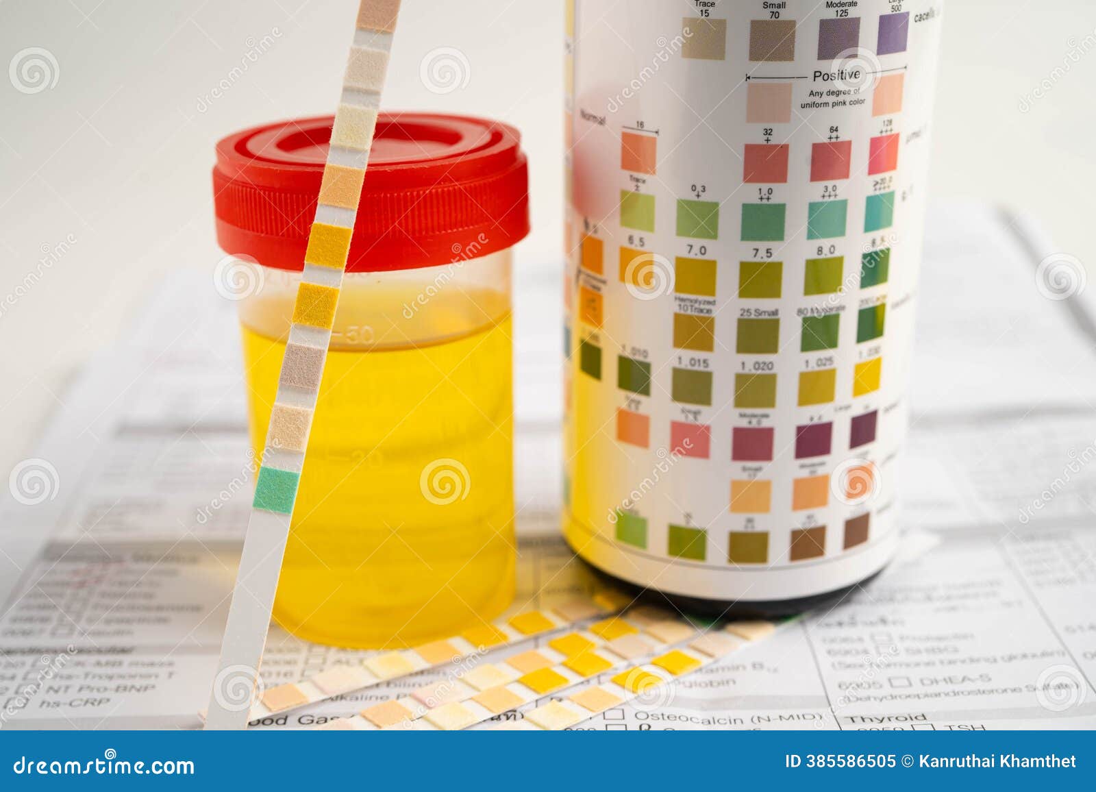 Urinalysis, Urine Cup With Reagent Strip PH Paper Test And Comparison ...