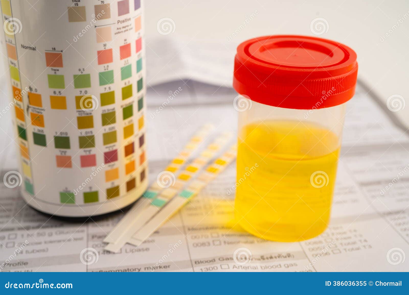 Urinalysis, Urine Cup With Reagent Strip PH Paper Test And Comparison ...