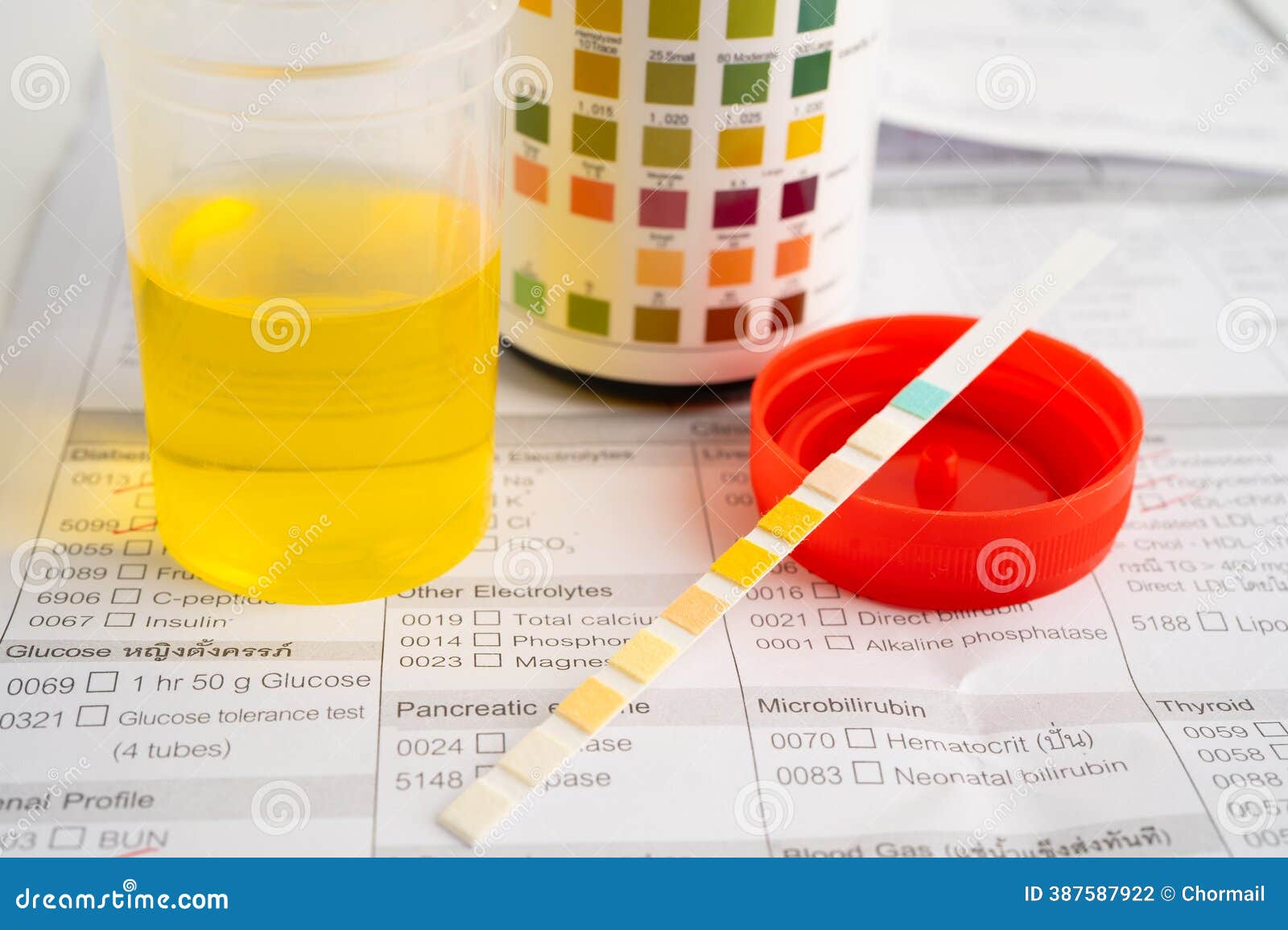 Reagent Strip For Urinalysis, Routine Urinalysis, Urine Test Analysis ...