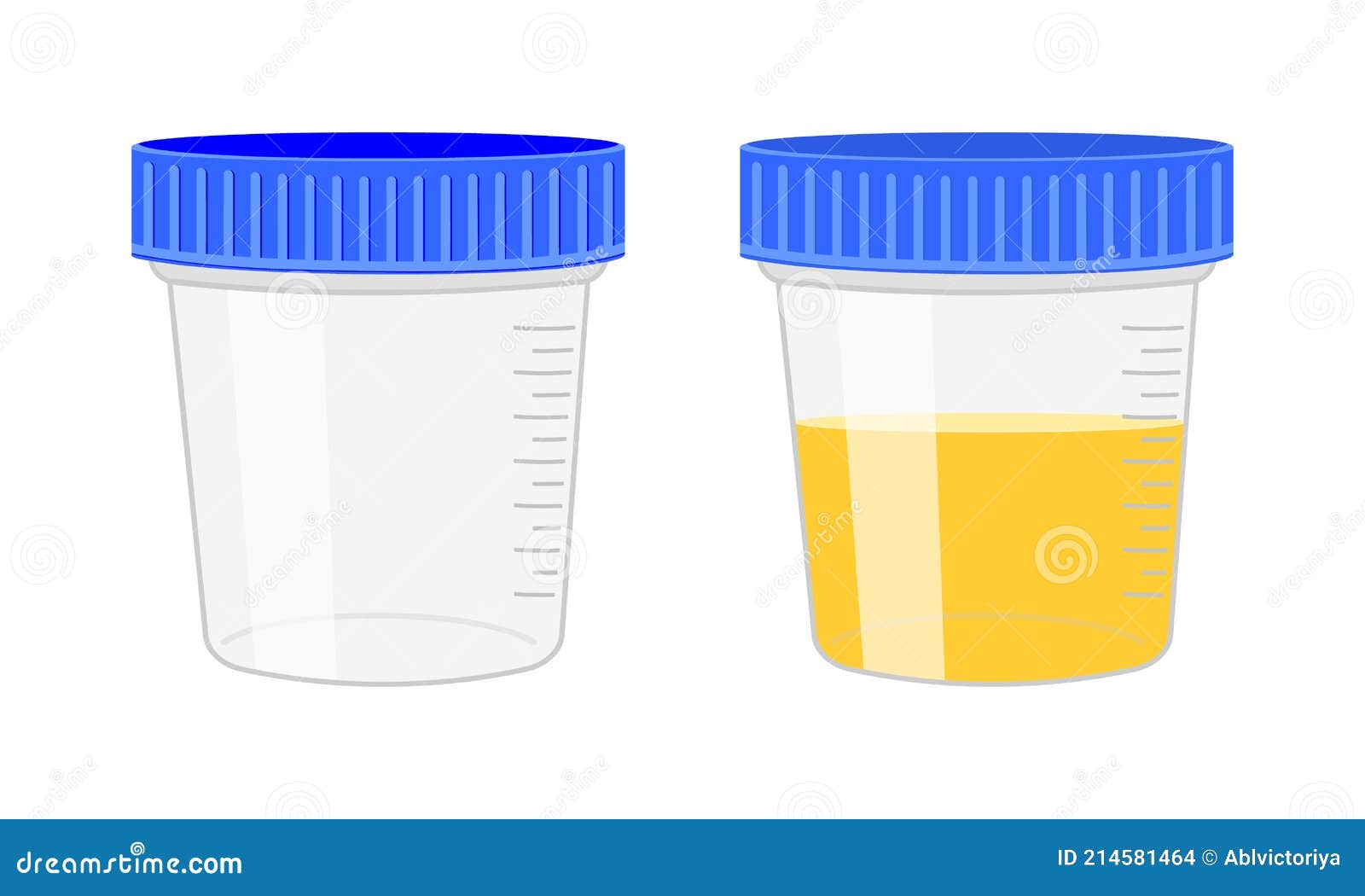 Urinalysis. Urine Sample, Empty and Full Plastic Containers. Laboratory ...