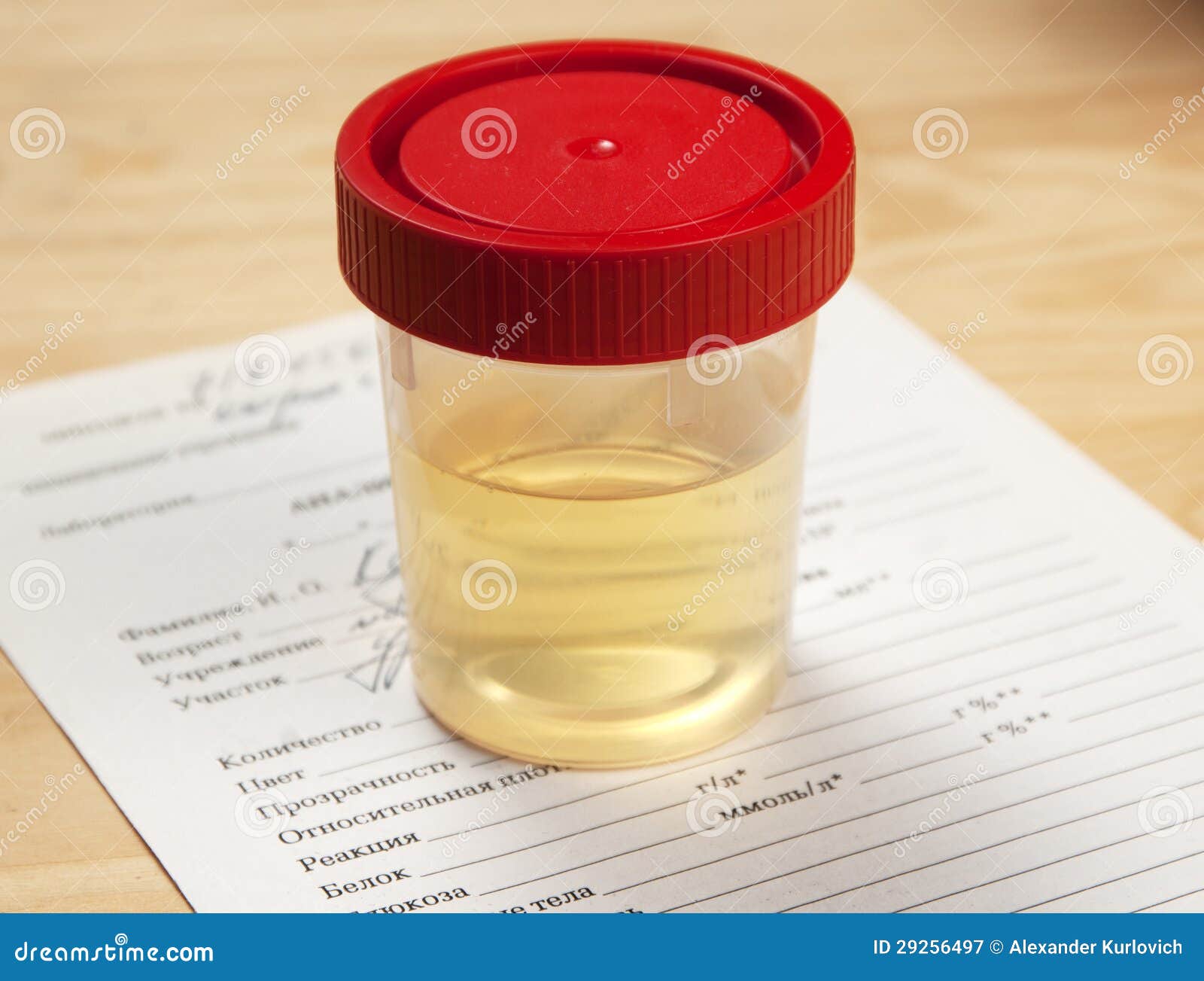 Urinanalyse stockbild. Bild von urin, formular, analyse - 29256497
