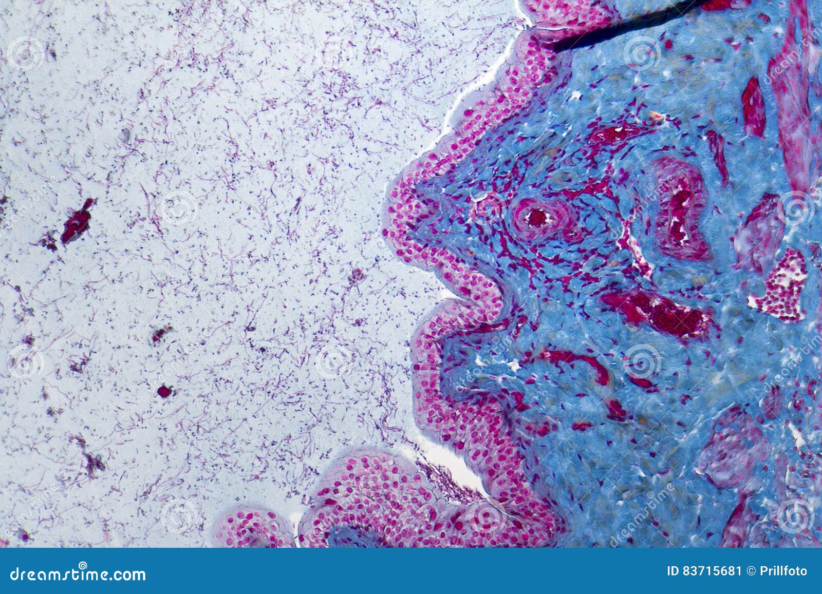 Urinary bladder micrograph stock image. Image of research - 83715681