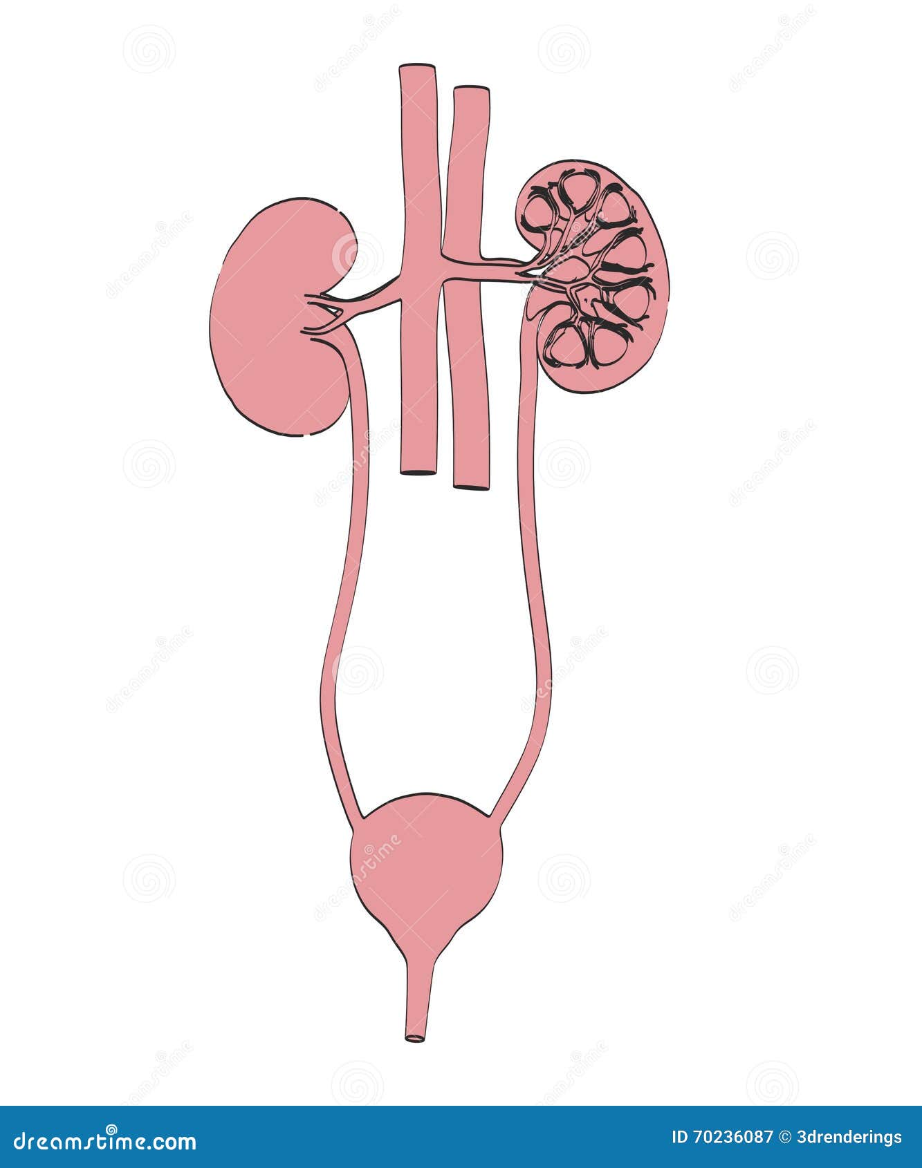 Urinary system stock illustration. Illustration of surgery - 70236087