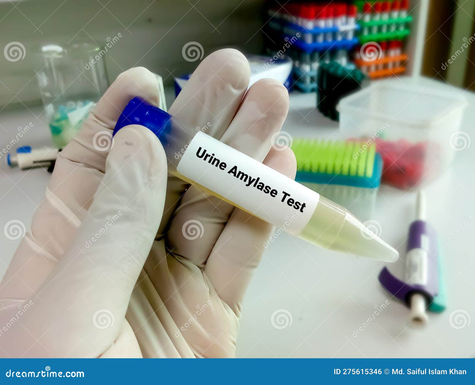 Urine amylase test stock photo. Image of doctor, closeup - 275615346