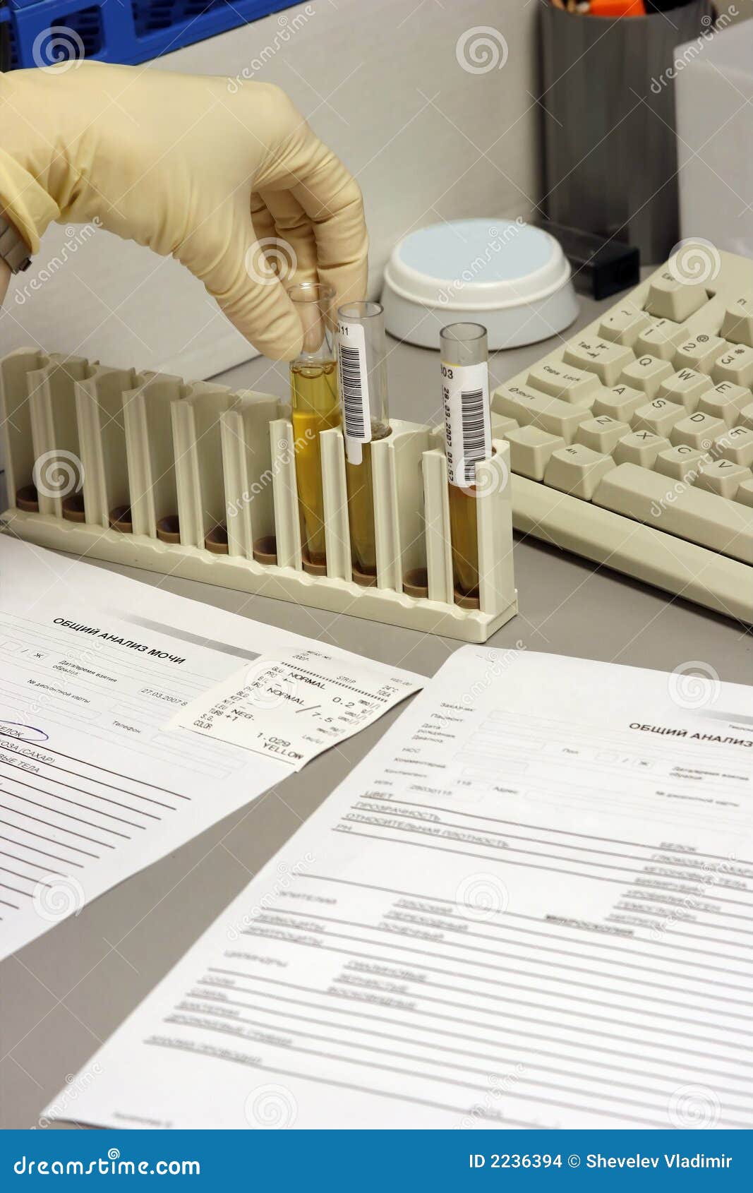 The urine analysis stock photo. Image of health, analyse - 2236394