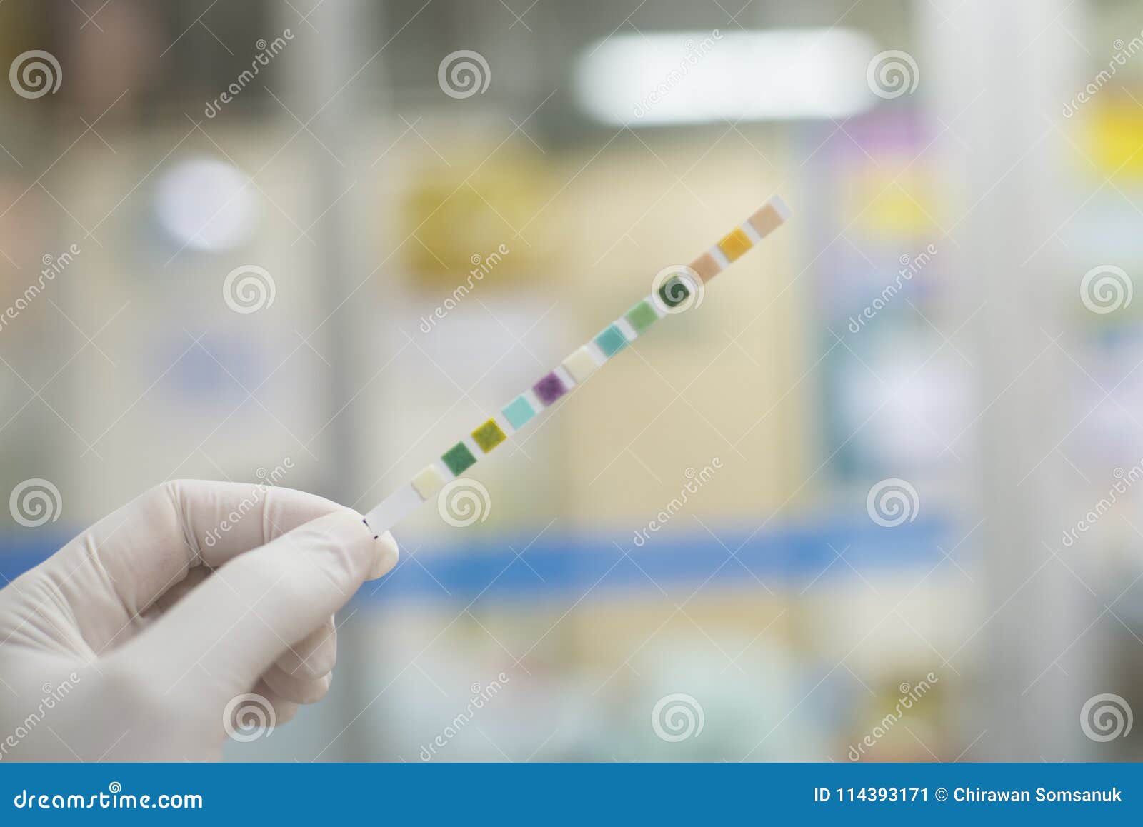 Laboratory Urine Test On White Background. Mycoplasma And Ureaplasma ...