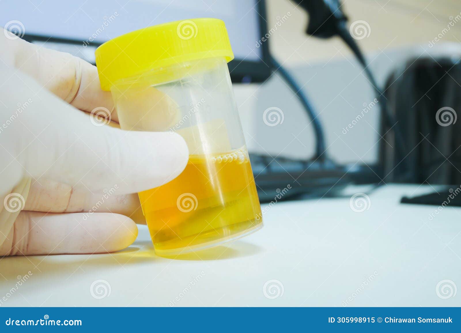 Urine Analysis in Laboratory Stock Image - Image of health, chemical ...