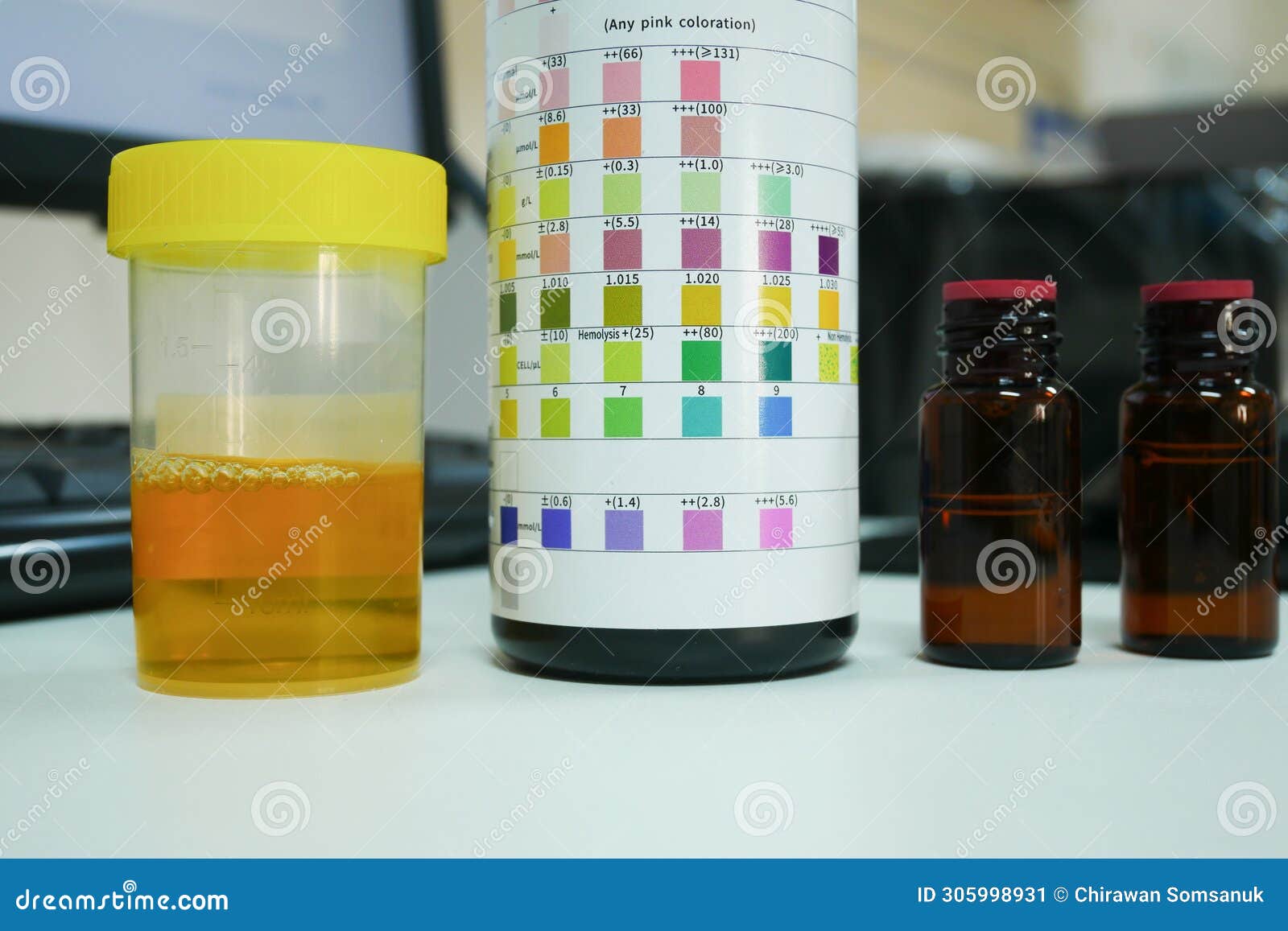 Urine Analysis in Laboratory Stock Image - Image of litmus, exam: 305998931