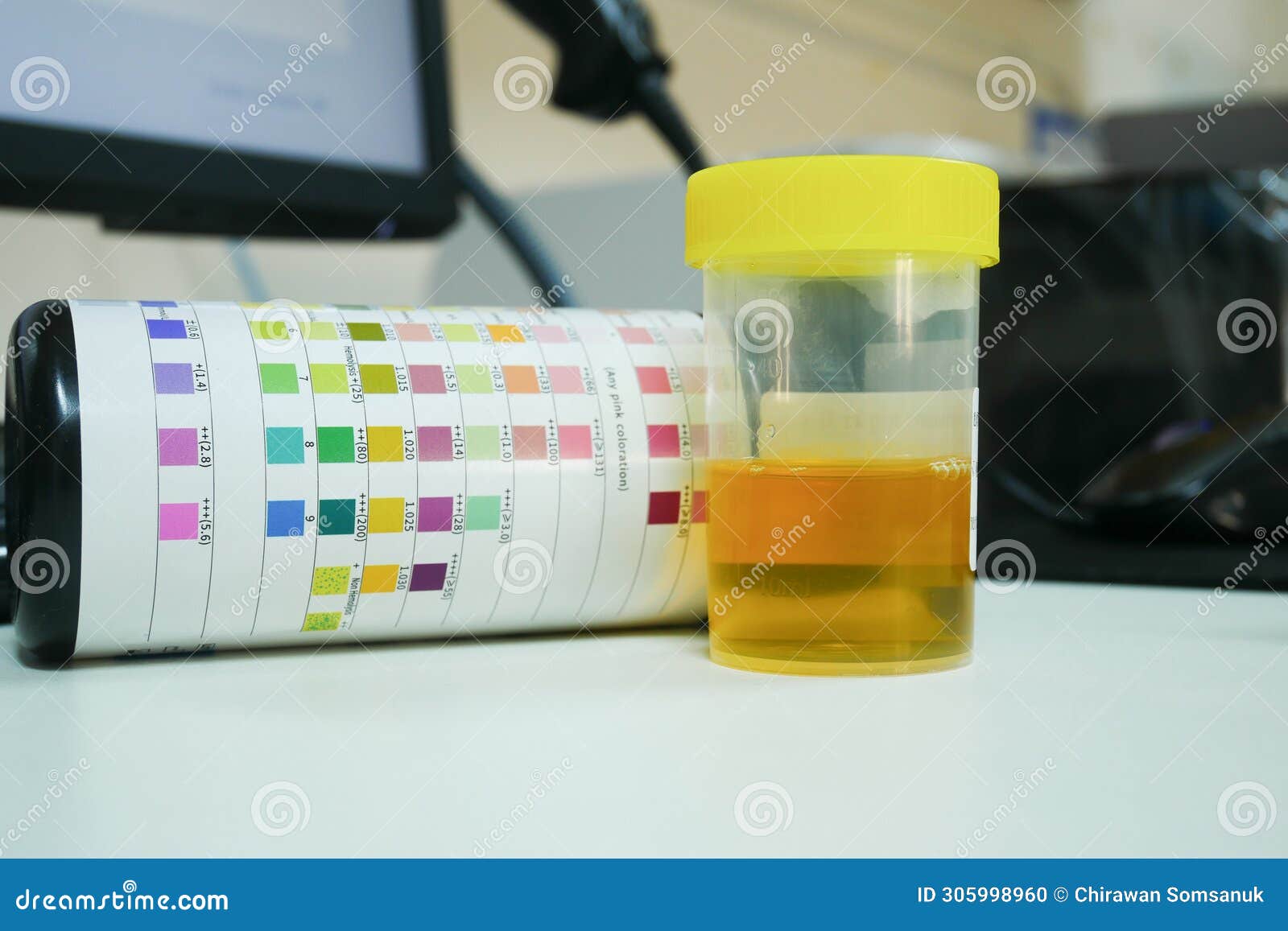Urine Analysis in Laboratory Stock Photo - Image of laboratory, chart ...