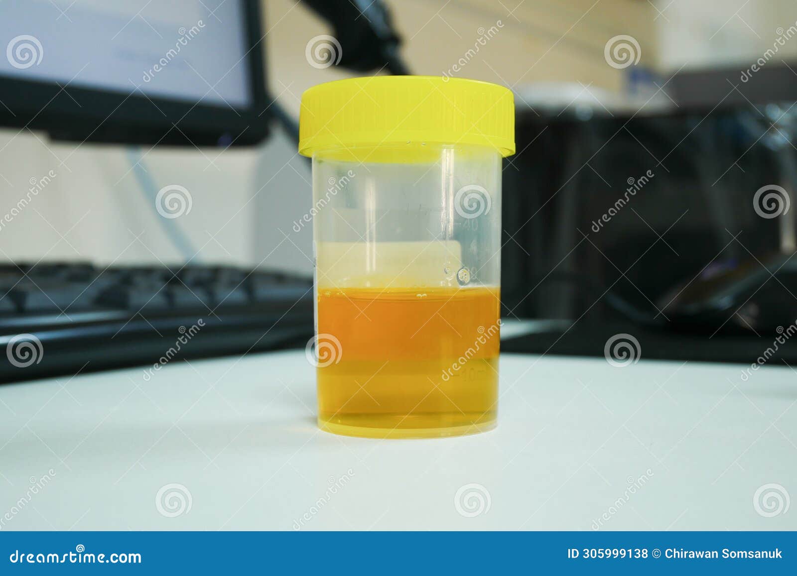 Urine Analysis in Laboratory Stock Photo - Image of chemical, analysis: 305999138