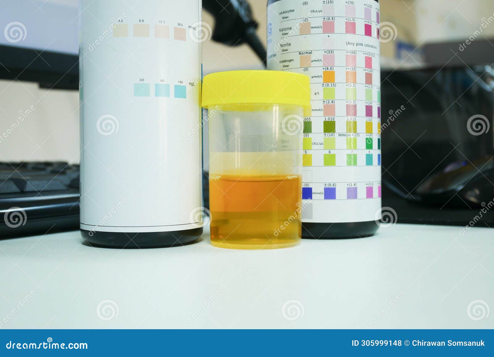 Urine Analysis in Laboratory Stock Photo - Image of check, clinic ...