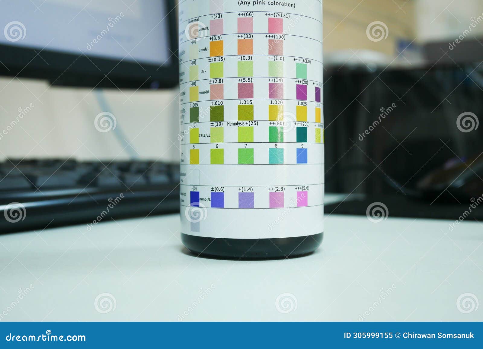 Urine Analysis in Laboratory Stock Image - Image of collection ...