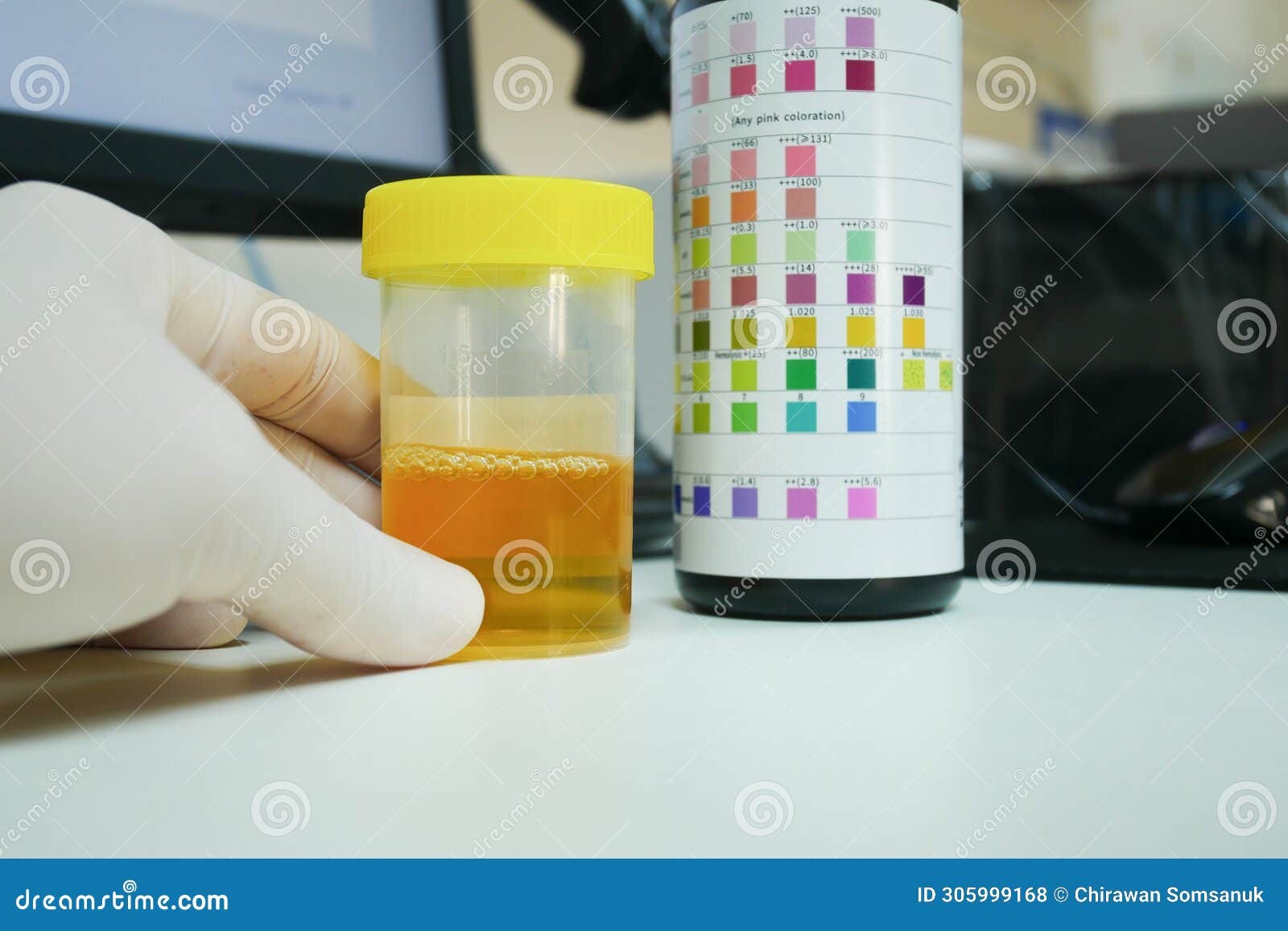 Urine Analysis in Laboratory Stock Photo - Image of exam, examination ...